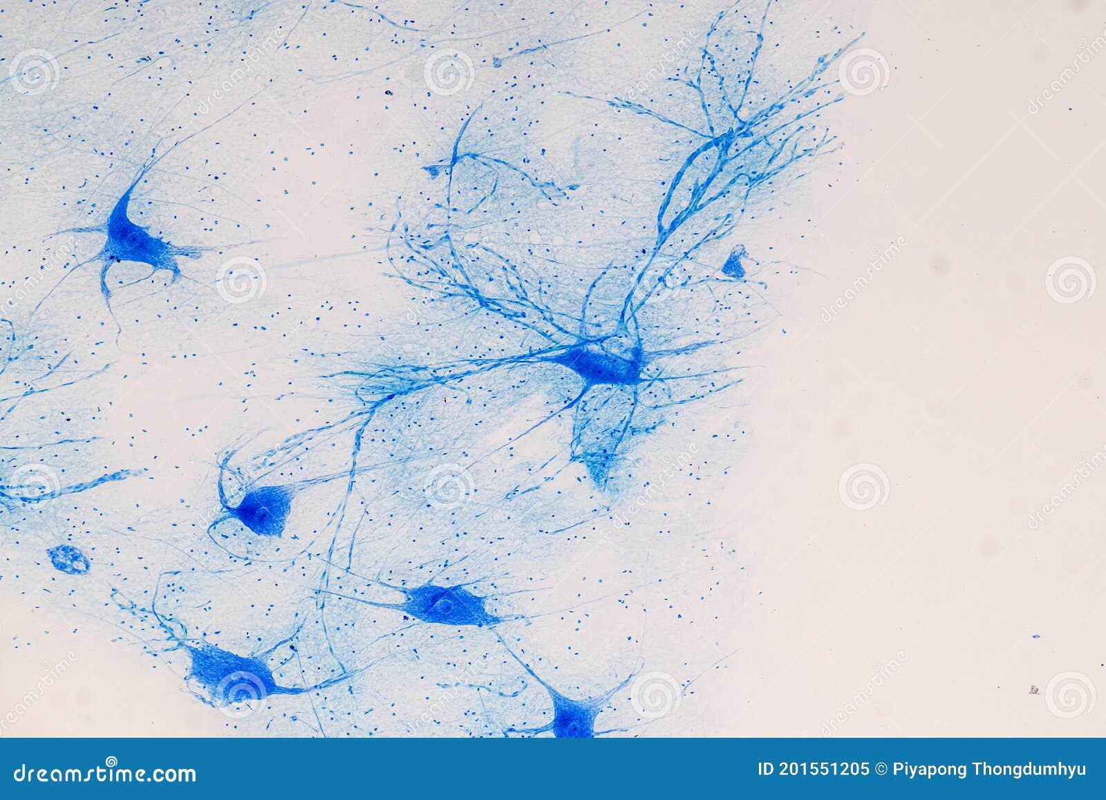 Motor Neuron Under the Microscope. Stock Image - Image of cord ...