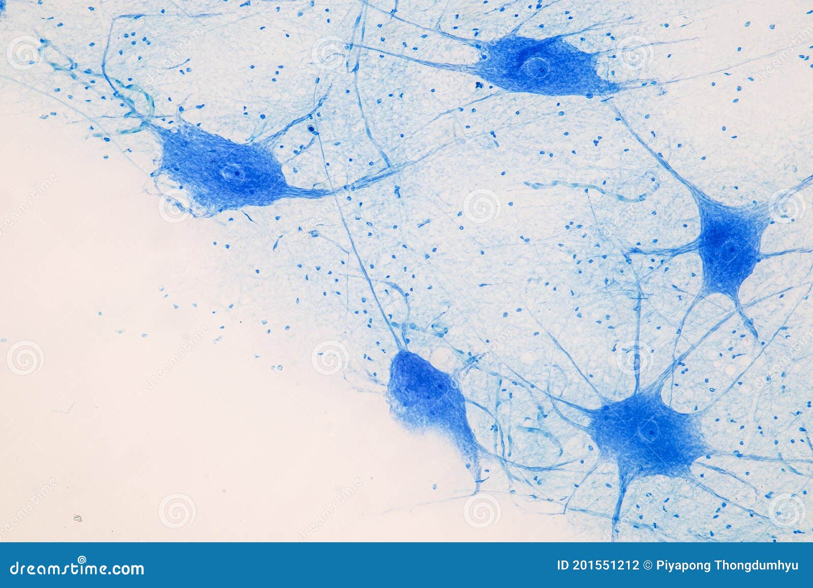 Motor Neuron Under the Microscope. Stock Photo - Image of cord ...