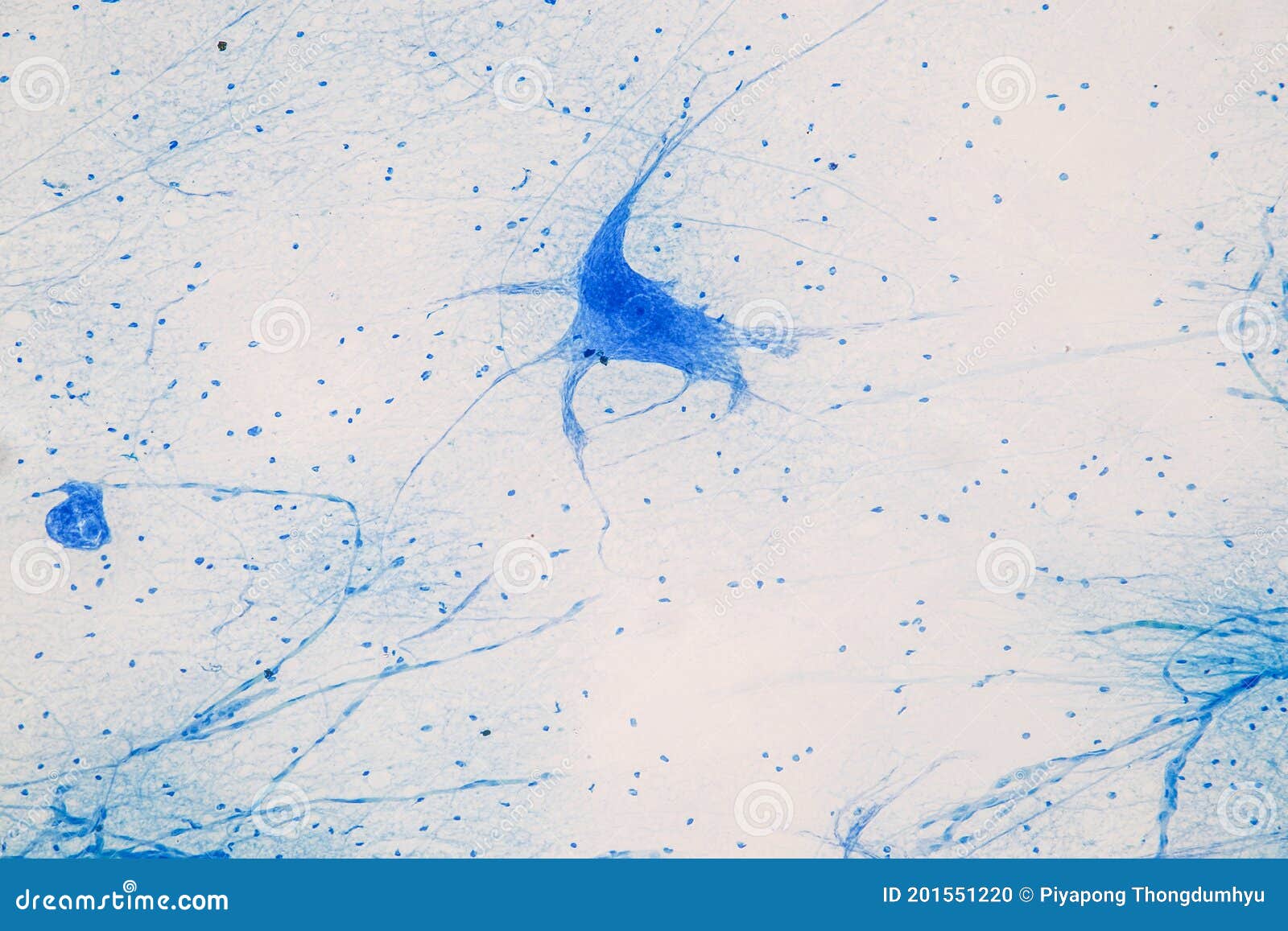 Motor Neuron Under the Microscope. Stock Photo - Image of matter ...