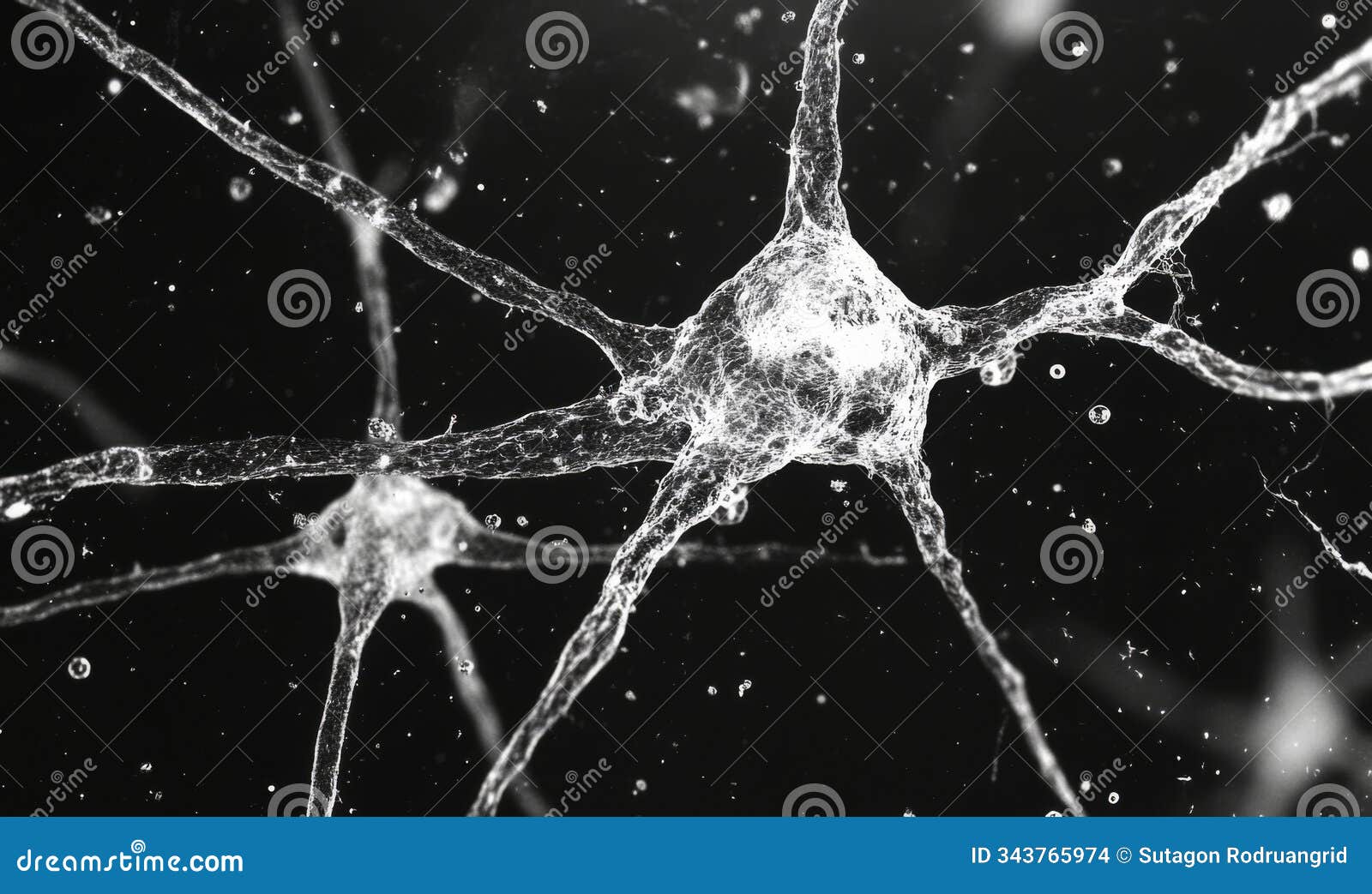 Motor Neuron, Spinal Cord, Nerve Fibres And Nerve Cells Under The ...