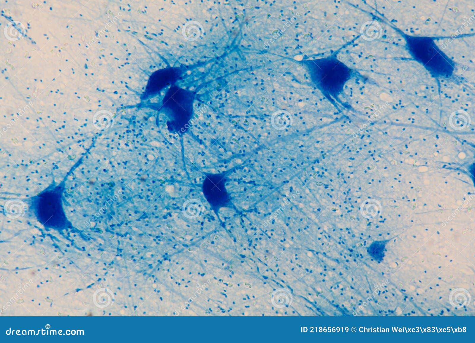 Motor Neurons Under The Microscope Royalty-Free Stock Photo ... Motor Neurons Under The Microscope Royalty-Free Stock Photo ...