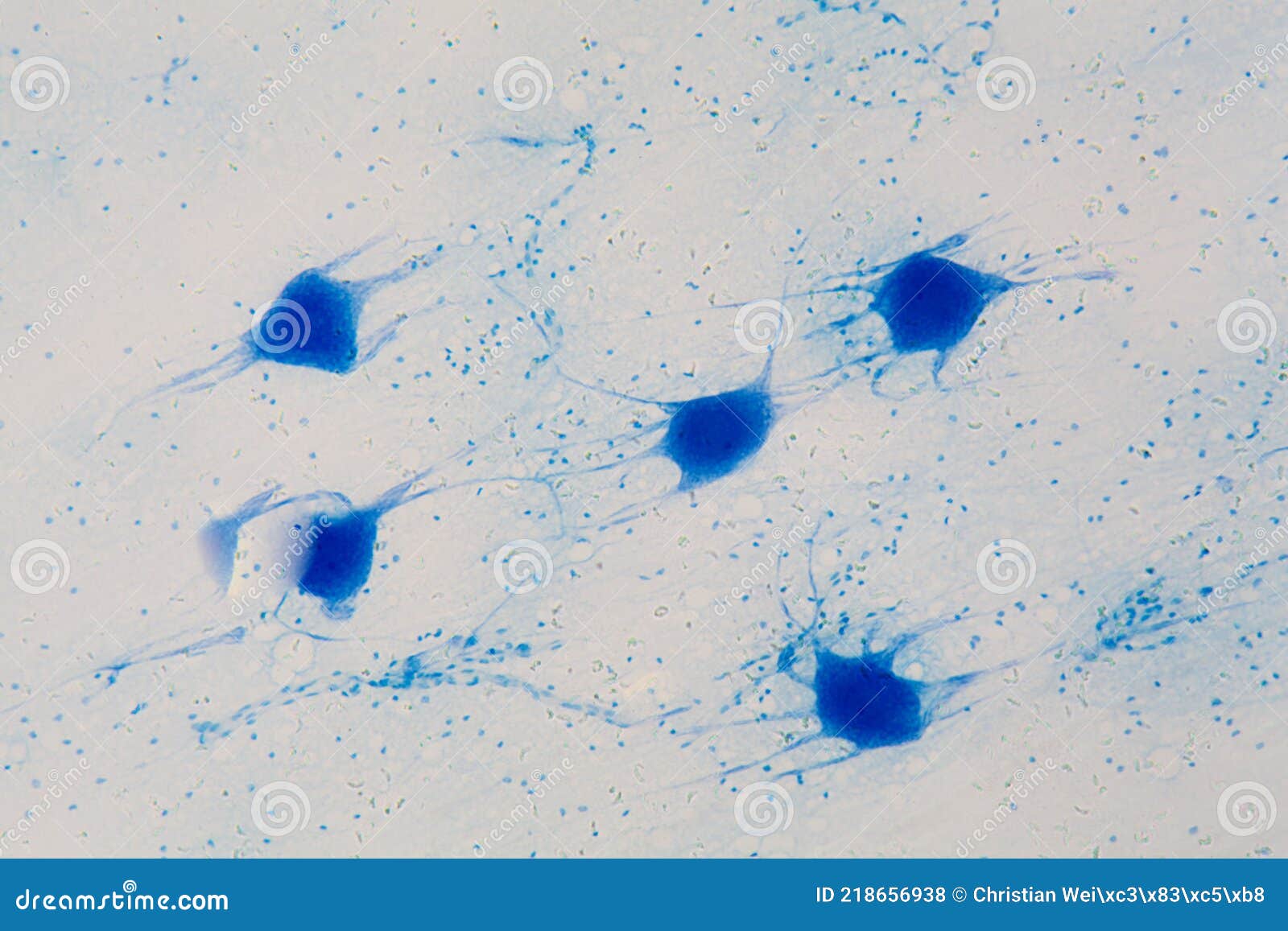 Motor Neurons Under the Microscope Stock Photo - Image of magnification ...