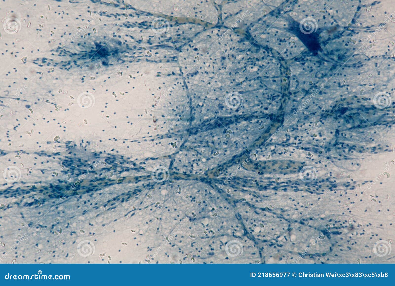 Motor Neurons Under the Microscope Stock Image - Image of microbiology ...