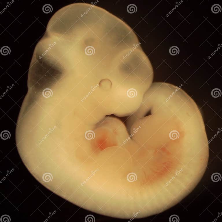 Mouse Embryo, Day 11 of Development Stock Image - Image of medical ...