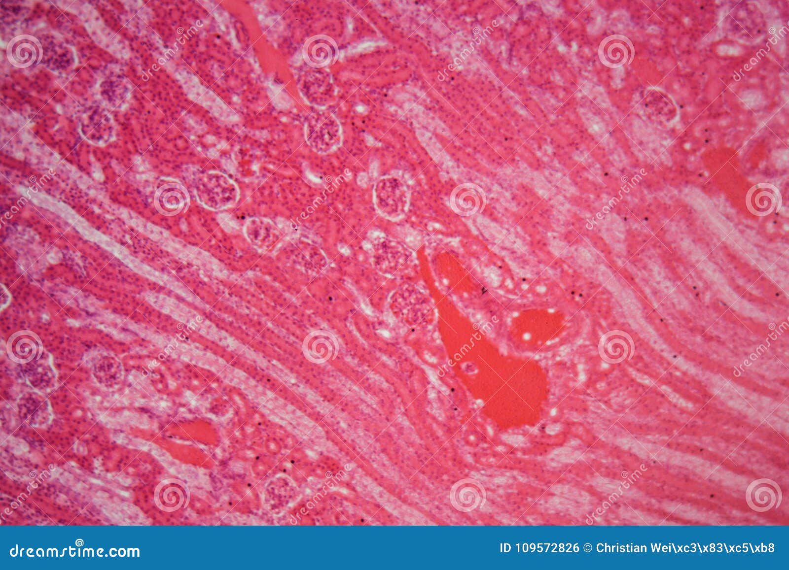 Mouse Kidney Under the Microscope Stock Photo - Image of cancer, micro ...