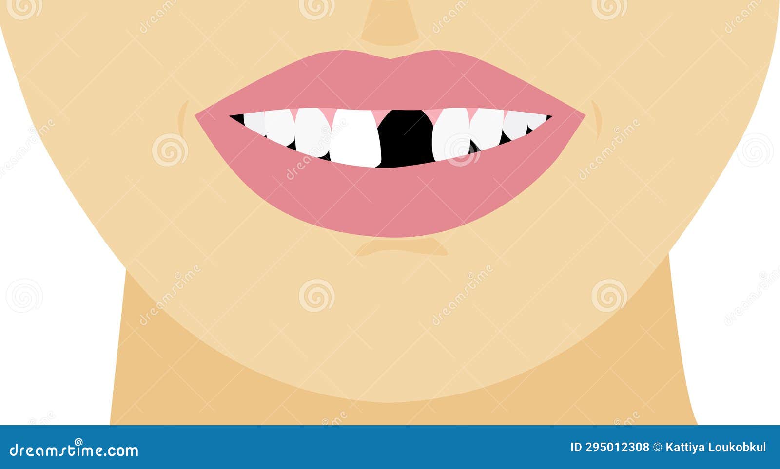 Mouth With Missing Teeth Cartoon Vector | CartoonDealer.com #106469689