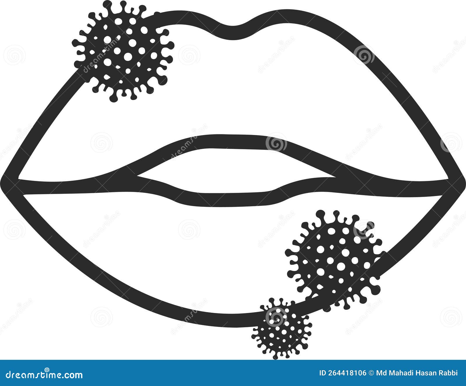 4 Types Of Infections Mind Map Text Concept For Presentations And ... 4 Types Of Infections Mind Map Text Concept For Presentations And ...