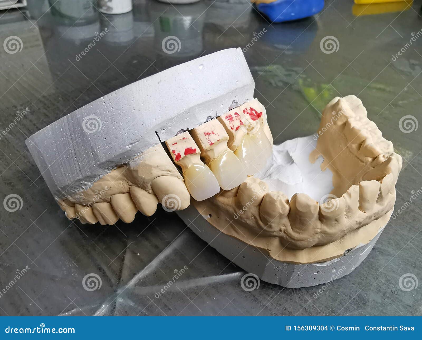 Porcelain Teeth - Color Guide Royalty-Free Stock Photography ...