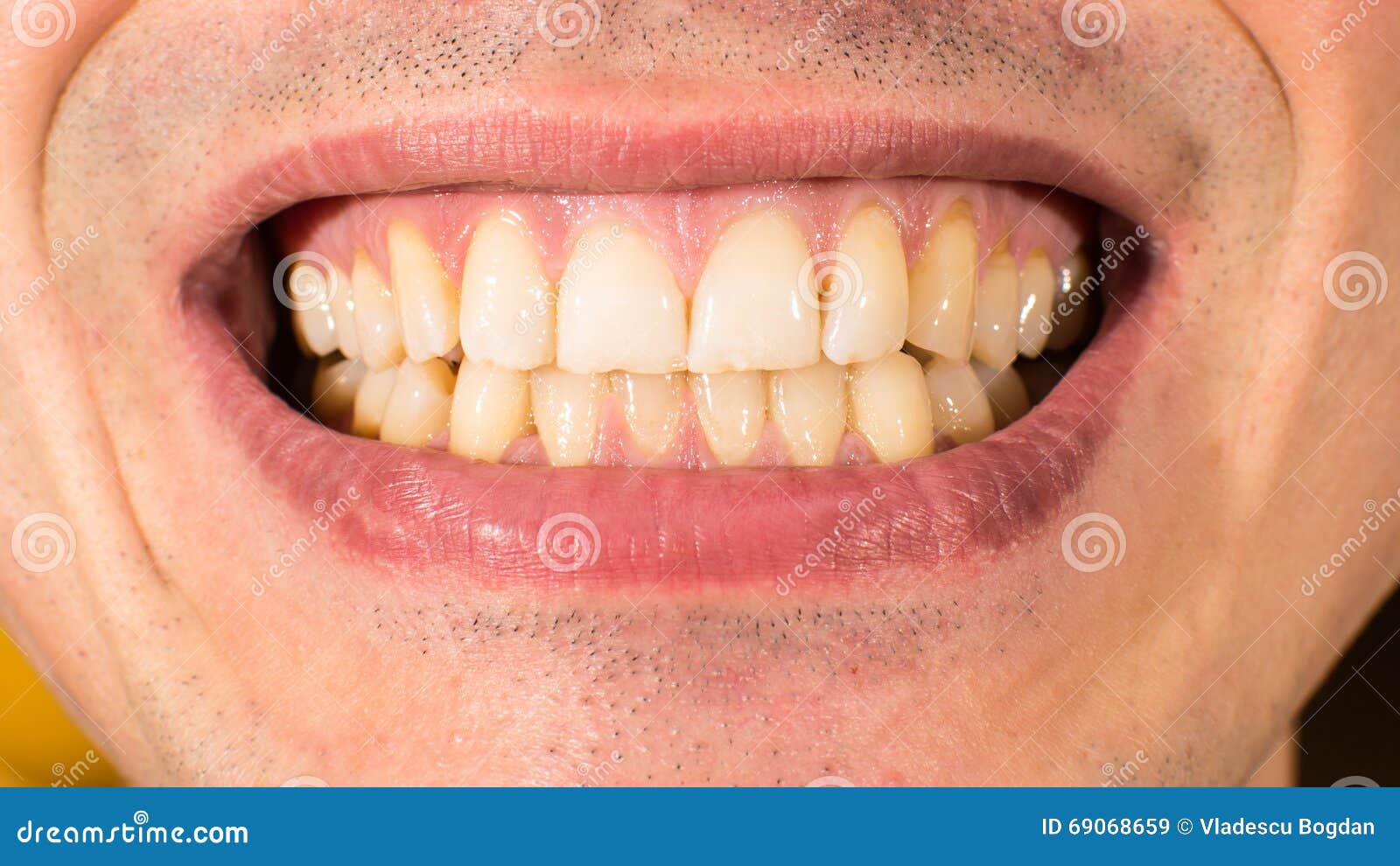 Mouth and teeth stock image. Image of showing, teeth - 69068659