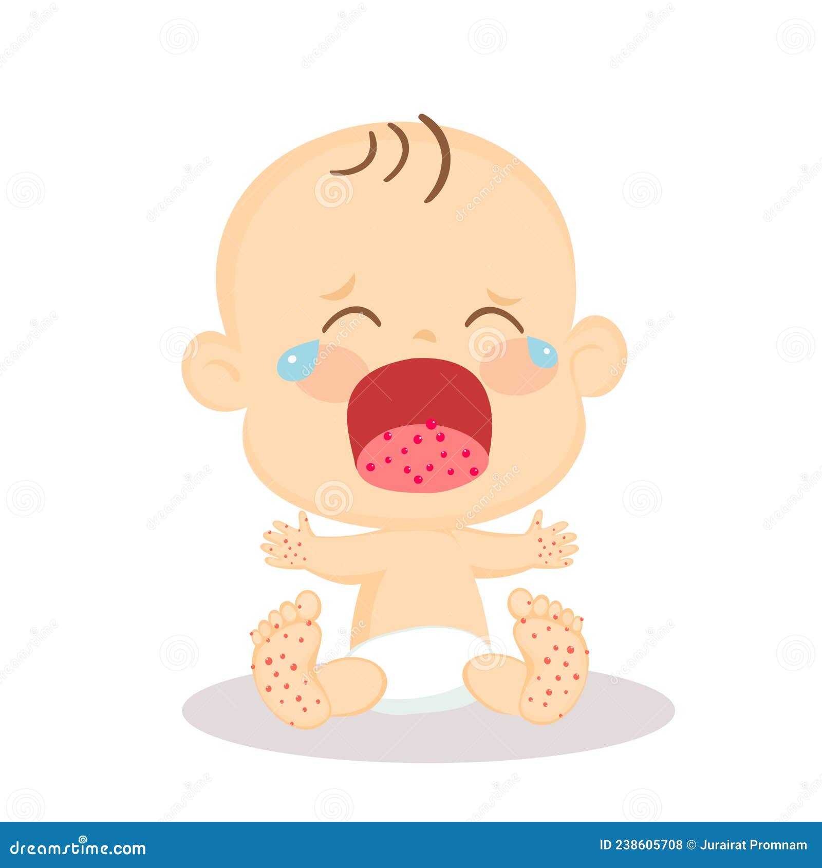 Mouth Ulcer Royalty-Free Stock Photo | CartoonDealer.com #598677