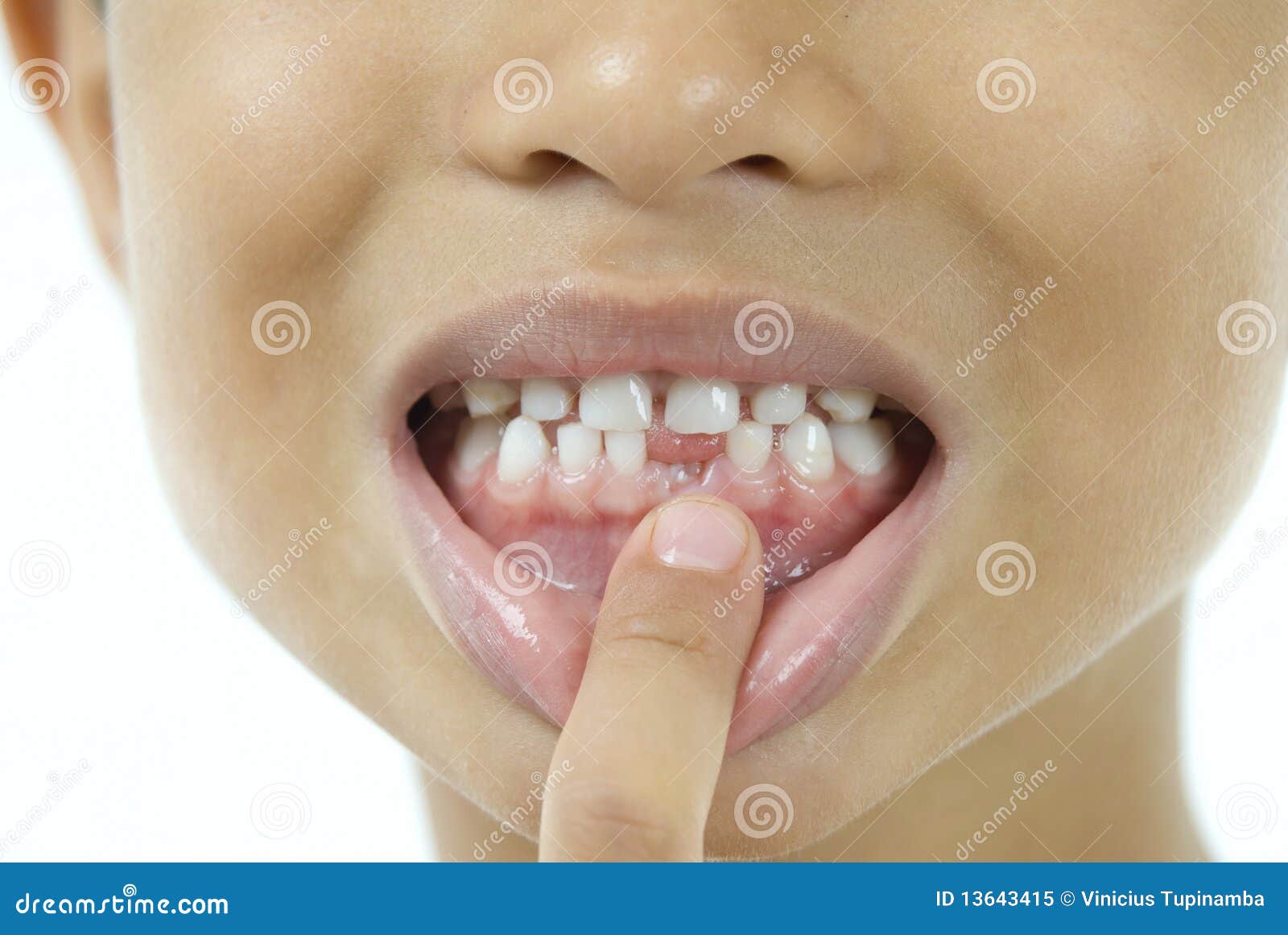 Mouth window stock image. Image of showing, finger, tooth - 13643415