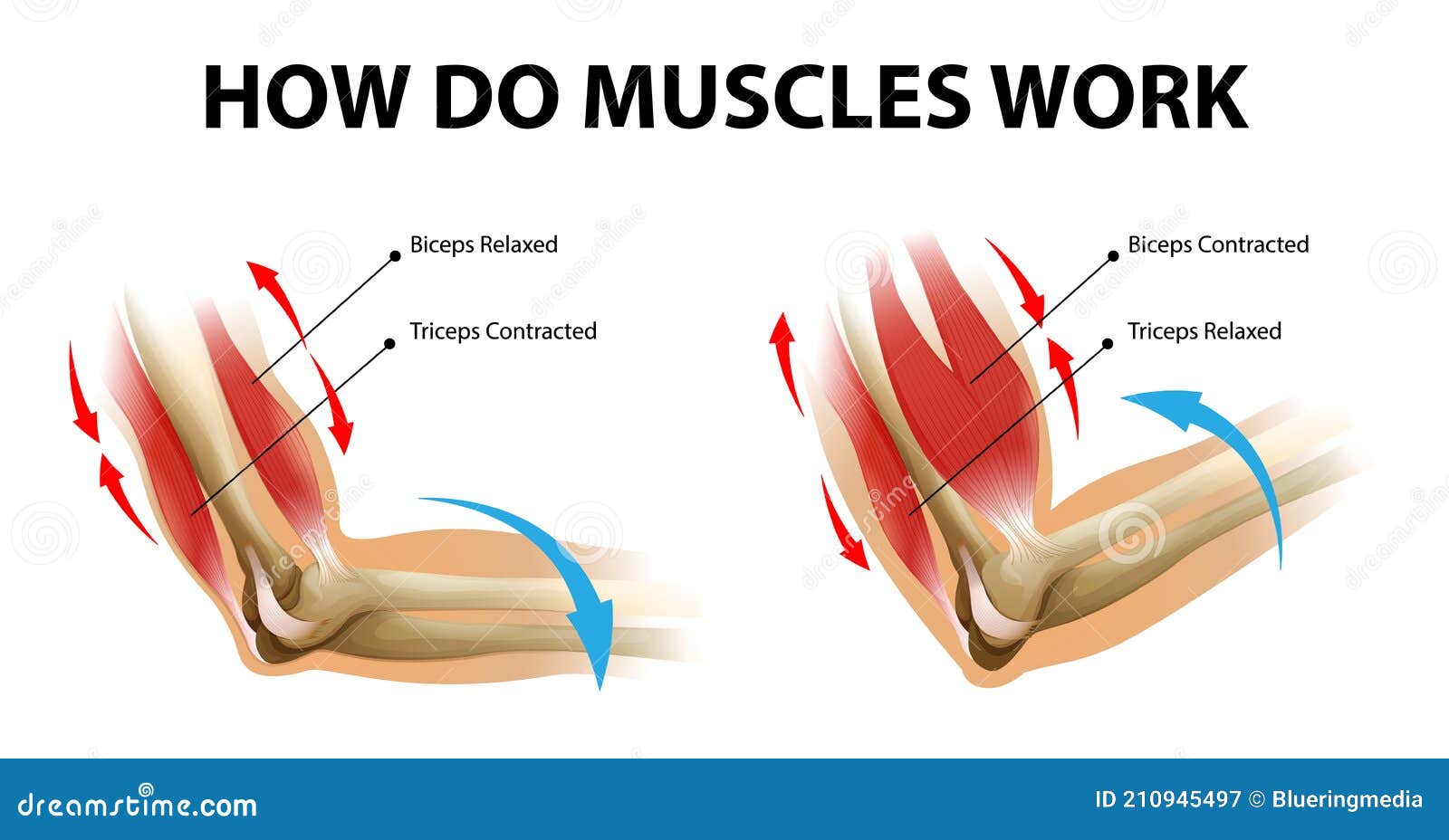 Process Of Muscle`s Stiffness And Pain / English Cartoon Vector ...