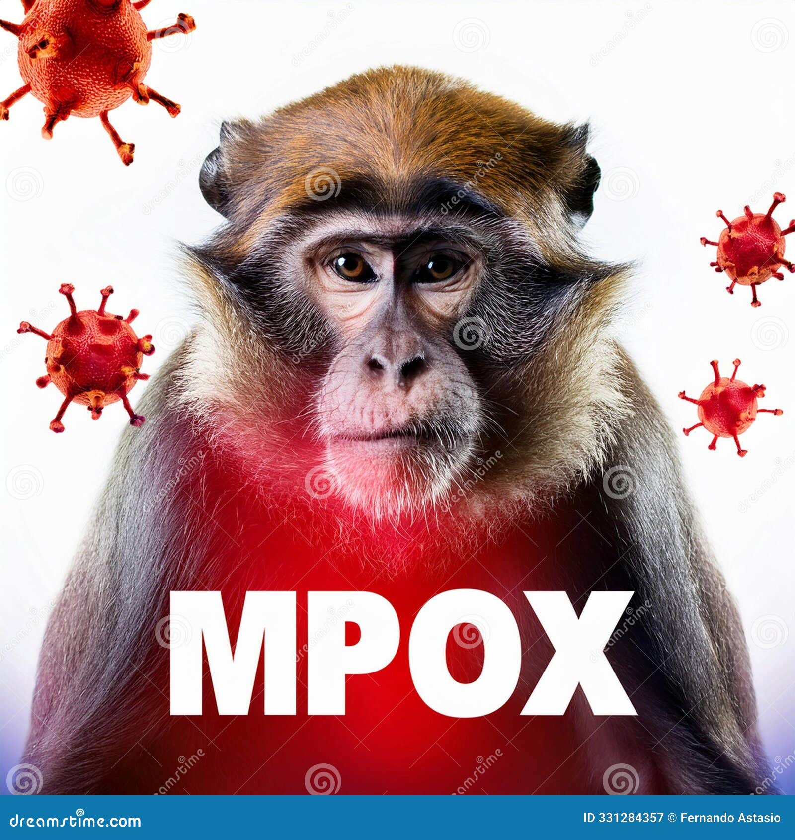 Mpox. Clade 1b. Monkeypox. Monkeypox Blisters on Arm. Virus, Epidemic ...