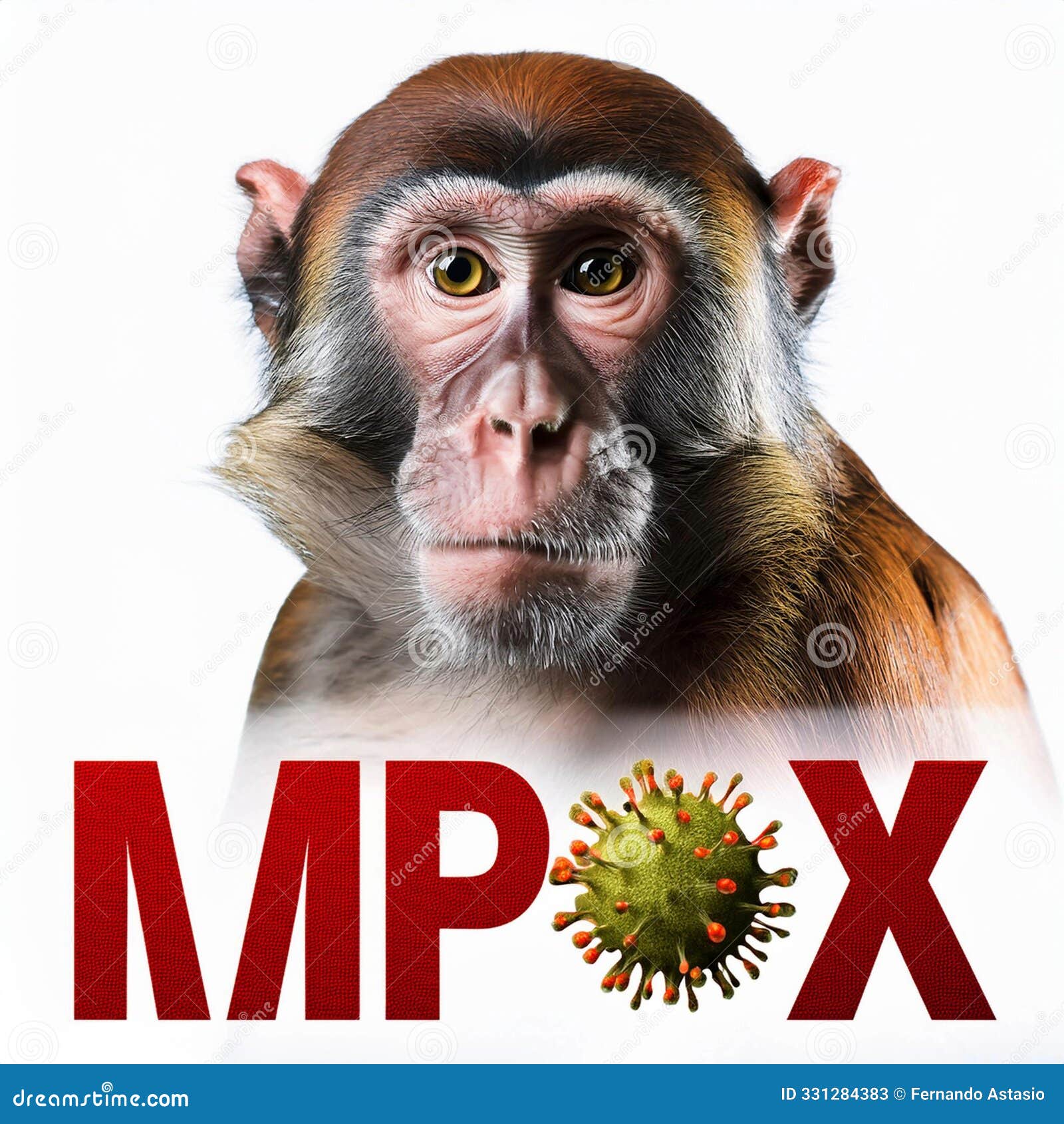 Mpox. Clade 1b. Monkeypox. Monkeypox Blisters On Arm. Virus, Epidemic ...