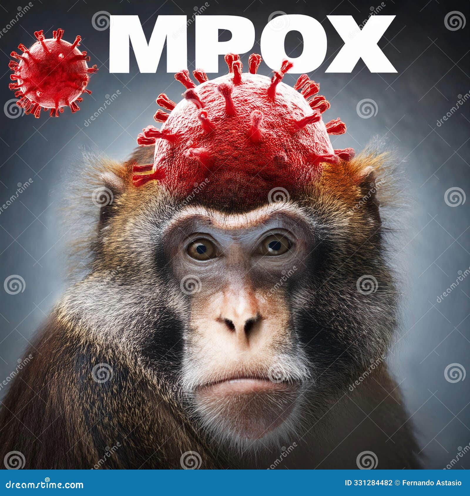 Mpox. Clade 1b. Monkeypox. Monkeypox Blisters On Arm. Virus, Epidemic ...