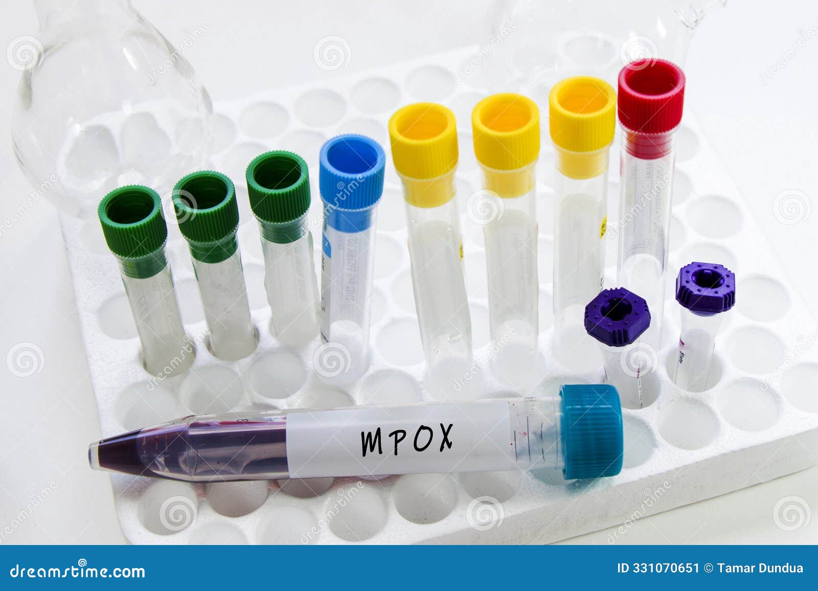 Mpox monkeypox virus stock image. Image of monkeypox - 331070651