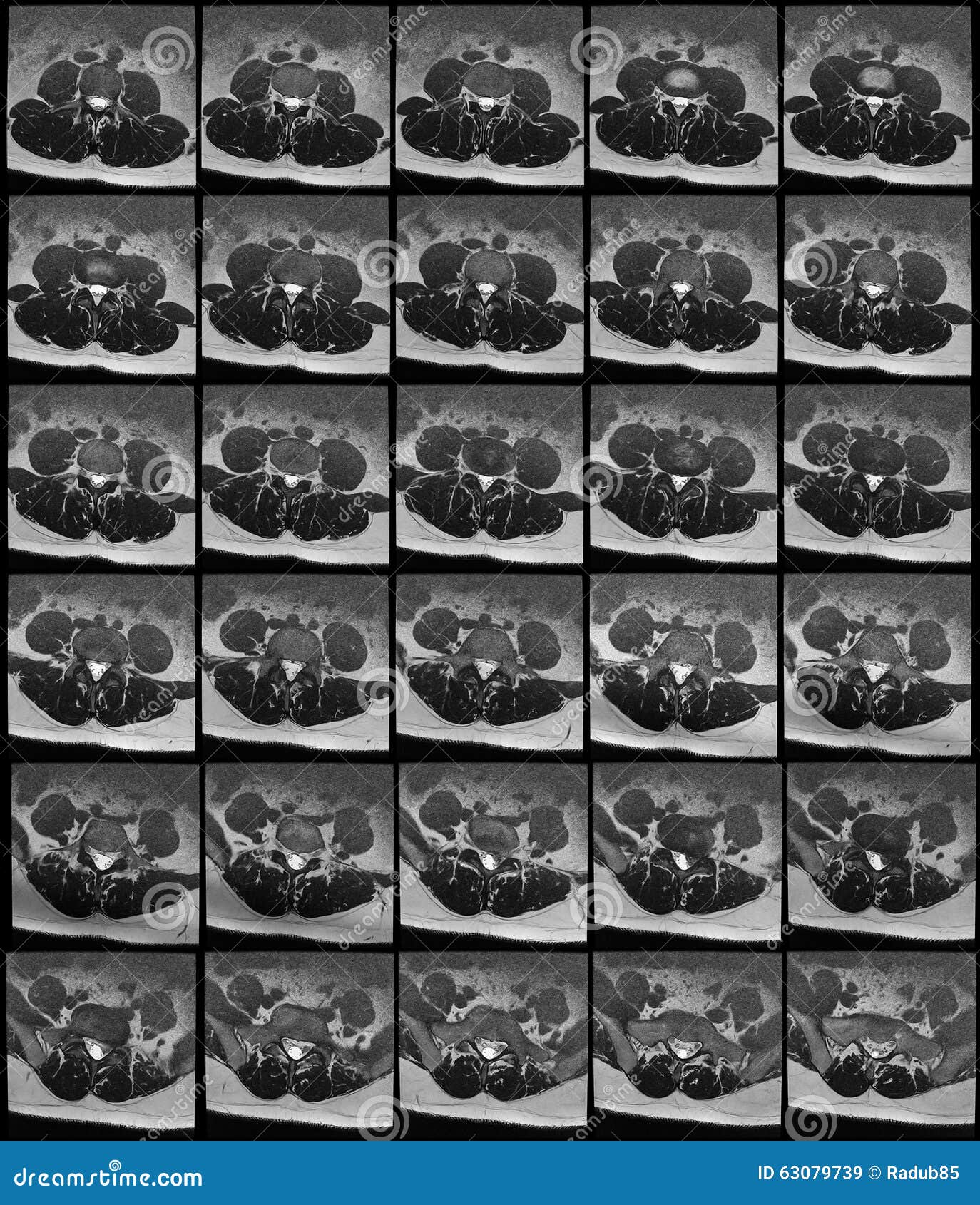 MRI Of Abdomen Organs And Column Spine Section Royalty-Free Stock ...