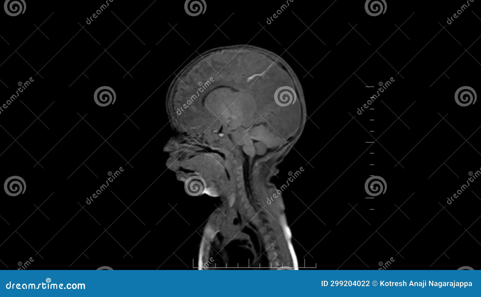 MRI Body Scanning of an Human Stock Footage - Video of intelligence ...