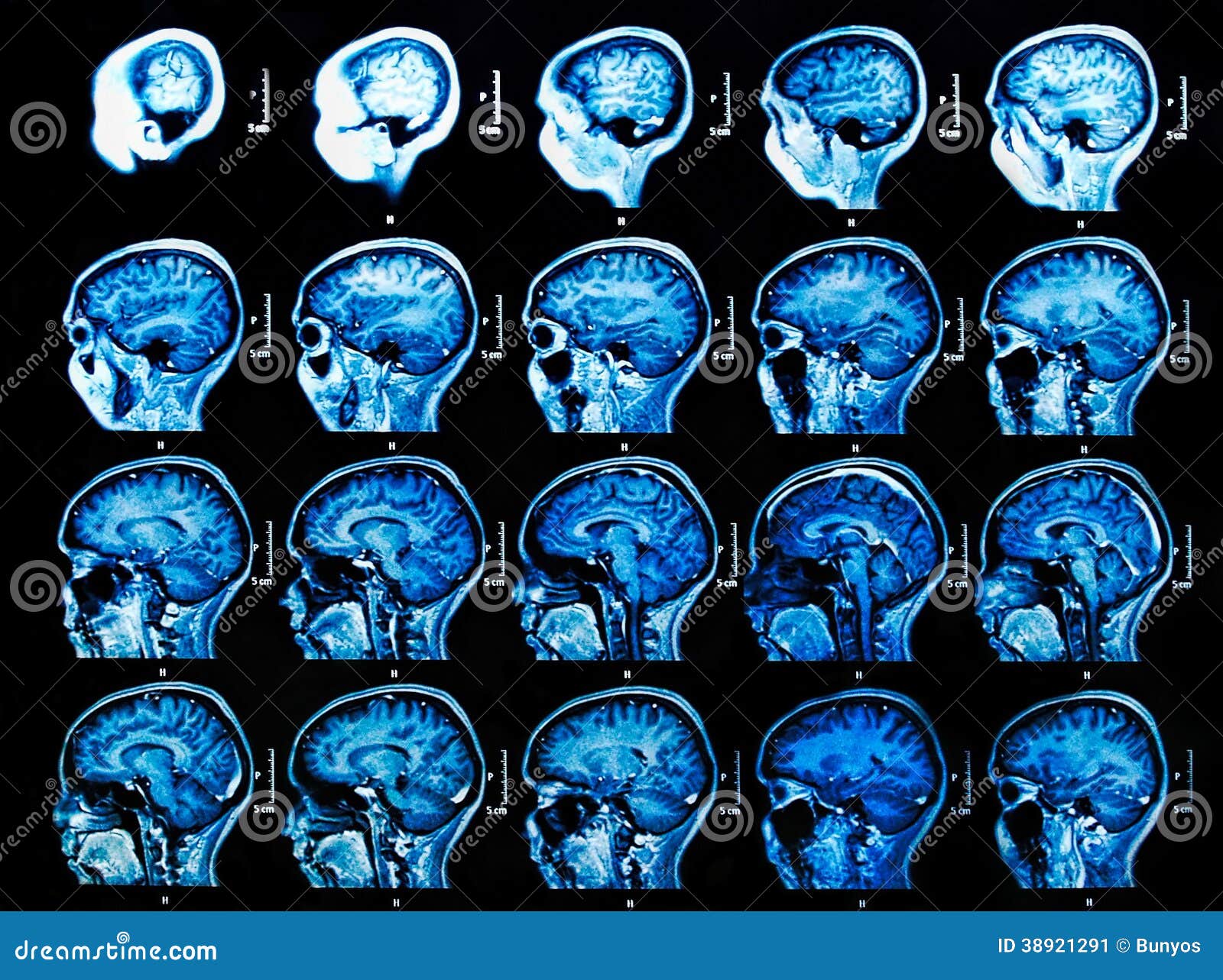 MRI Brain Scan stock image. Image of nasal, hemisphere - 38921291