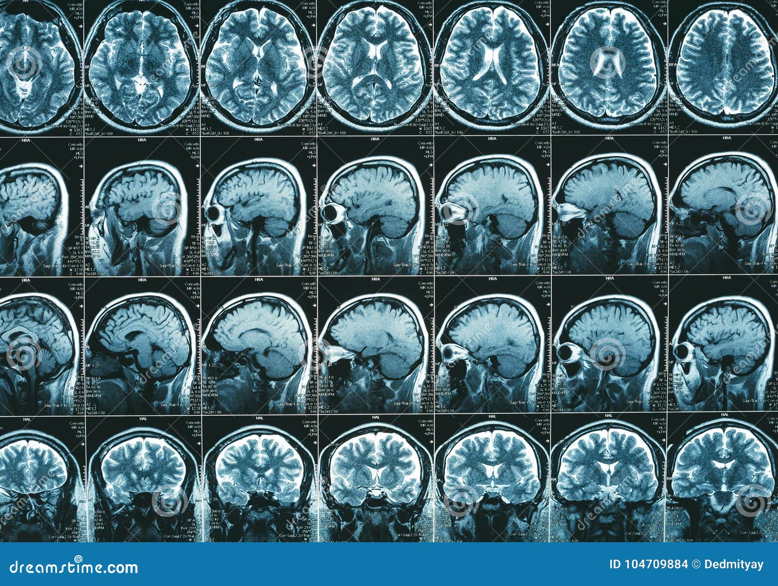 MRI Brain Scan or Magnetic Resonance of Head Image Results Editorial ... MRI Brain Scan or Magnetic Resonance of Head Image Results Editorial ...