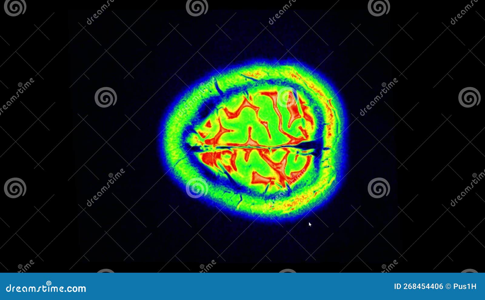 Mri Brain Scan Magnetic Resonance Image Ct Scan Of Human Brain In Dynamic Stock Footage