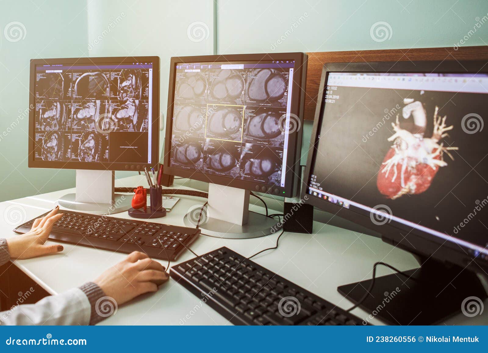 MRI CT Scanned Image Show on Computer in DataCenter Operation Room ...