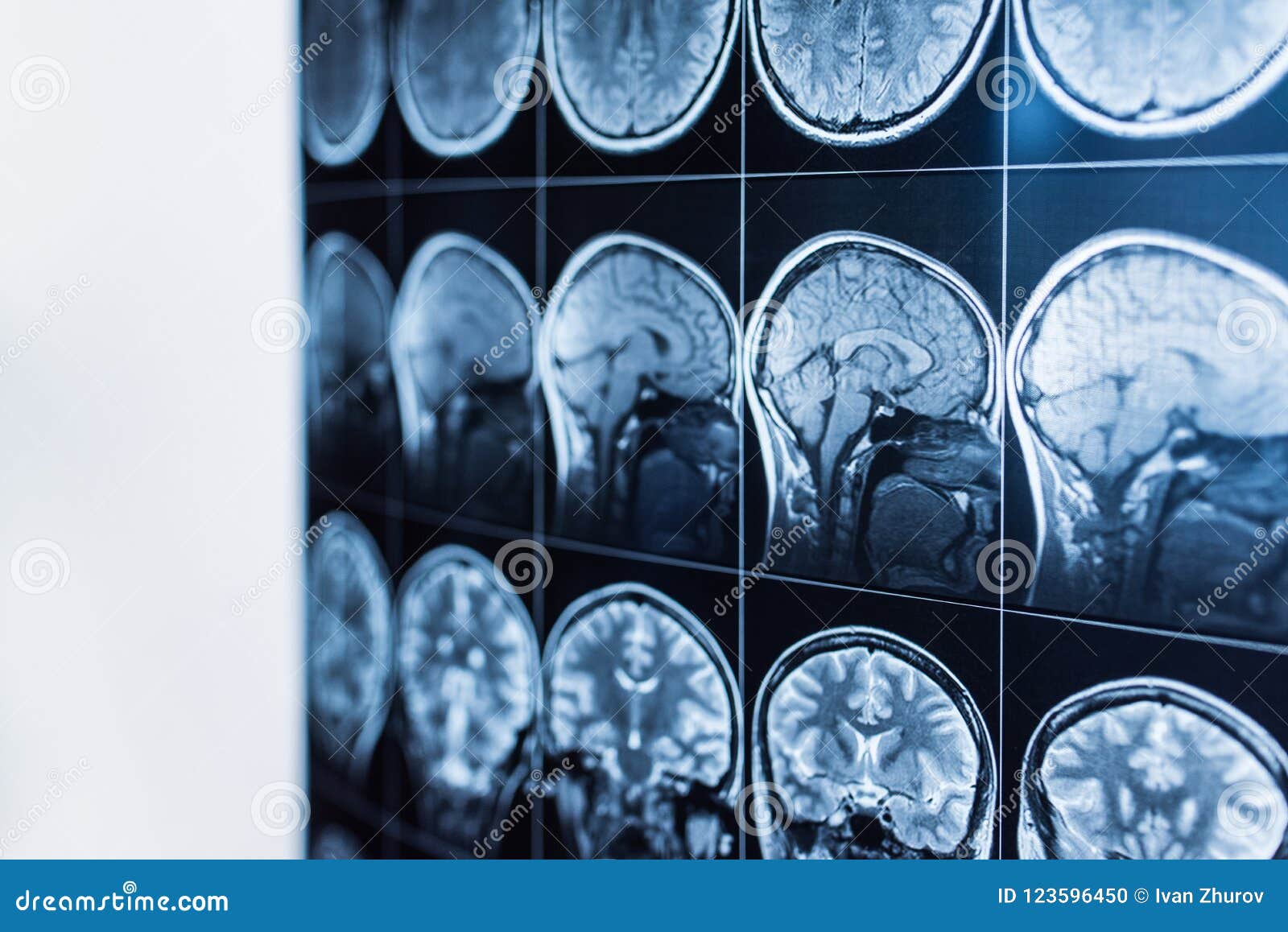 2,620 Mri Person Stock Photos - Free & Royalty-Free Stock Photos from ...