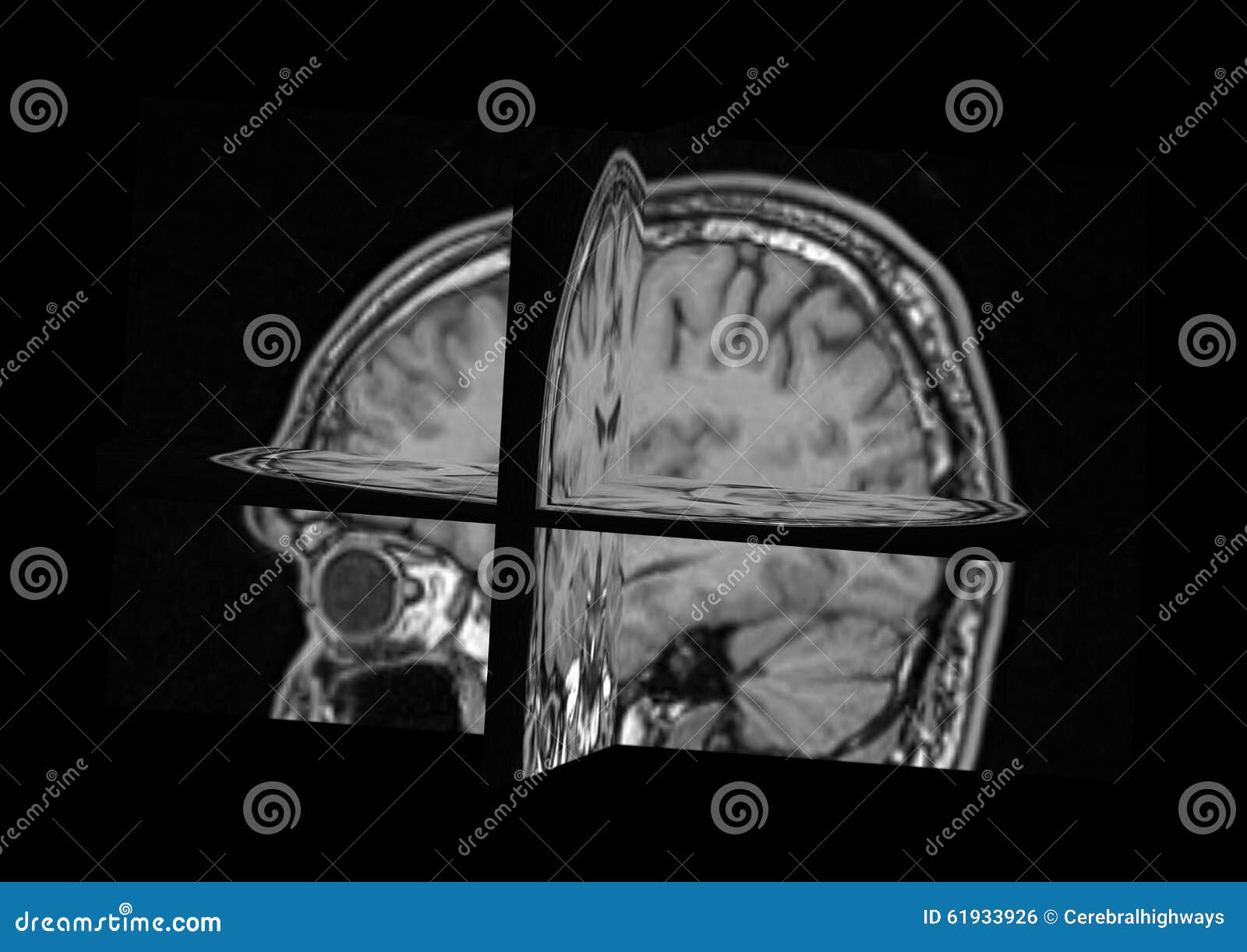 MRI-Hersenen 3D Mening stock foto. Image of anatomisch - 61933926