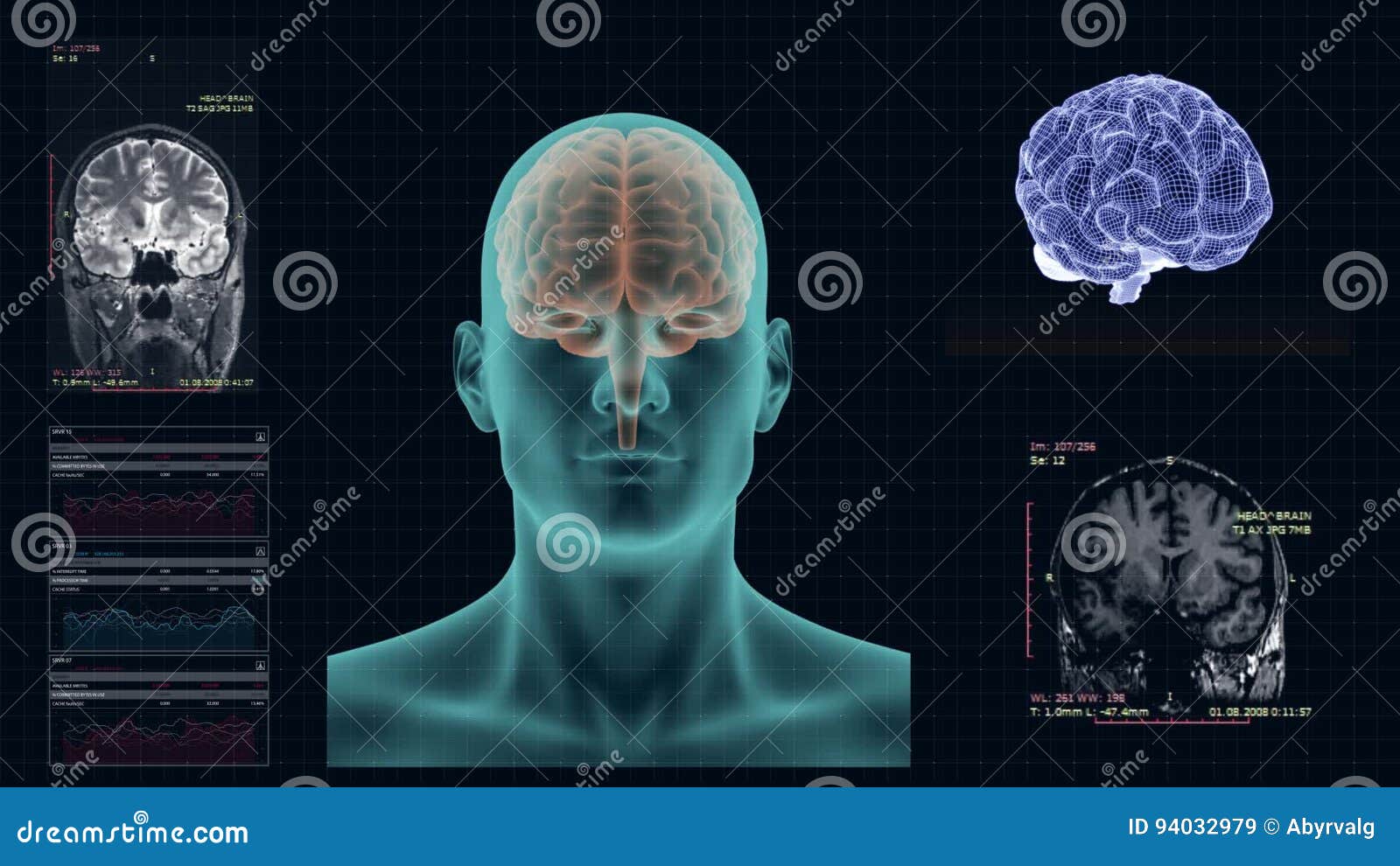MRI of the Human Brain in the Coronal Projection Stock Video - Video of ...