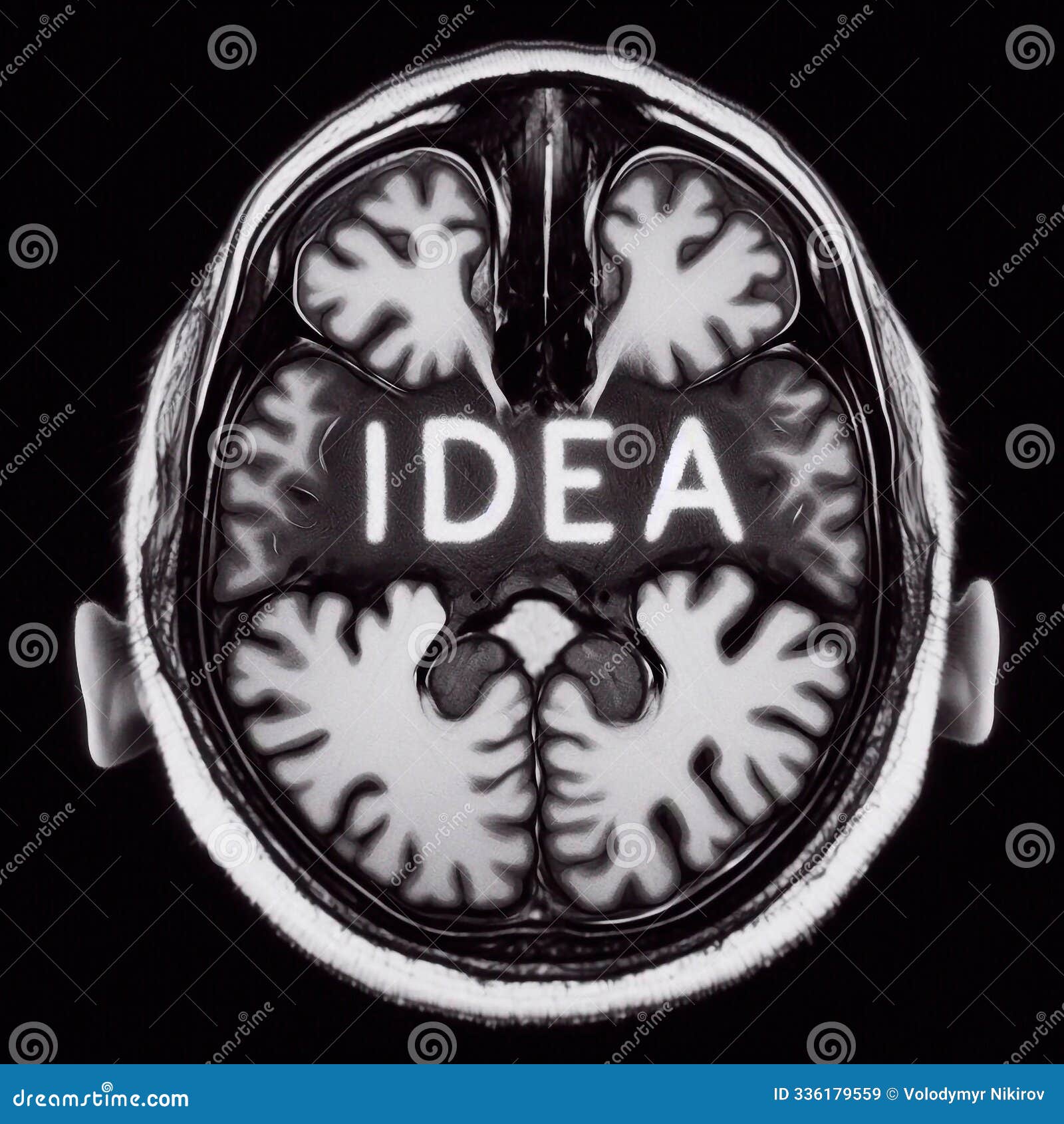 MRI Image of a Patient S Head after a Diagnostic Imaging Procedure ...