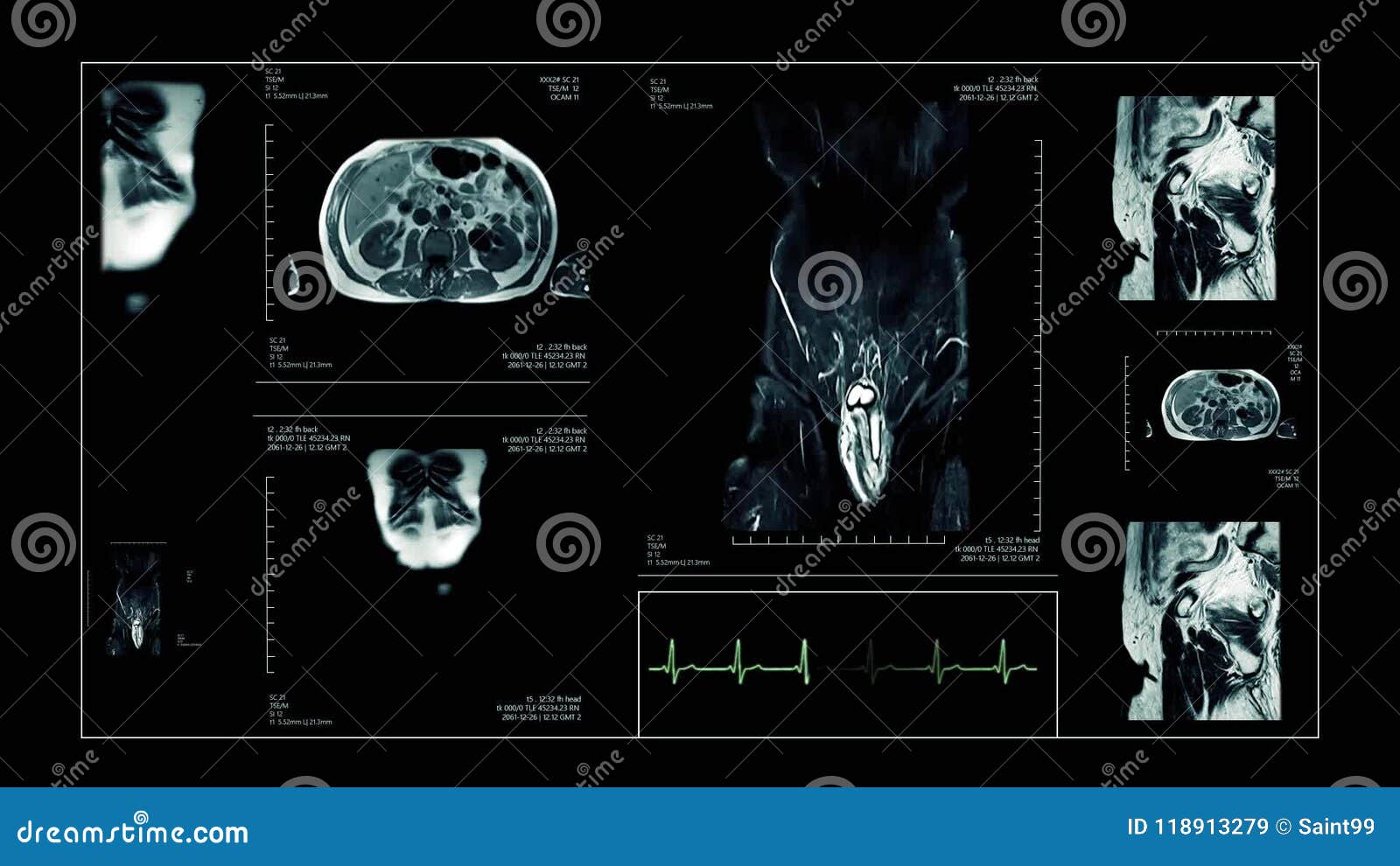 MRI live scan human body stock video. Video of scan - 118913279