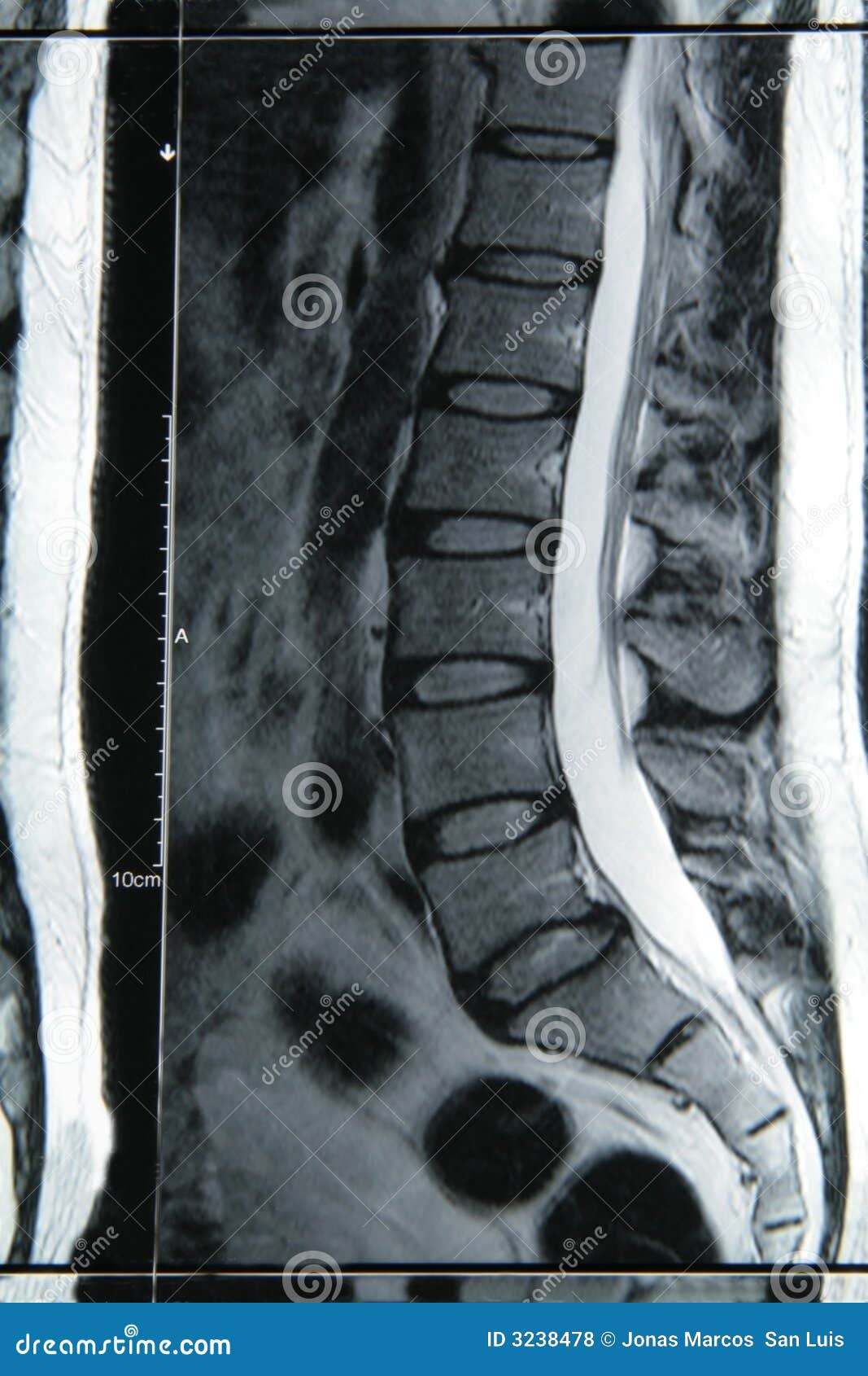 MRI result 1 stock photo. Image of radiology, radiography - 3238478
