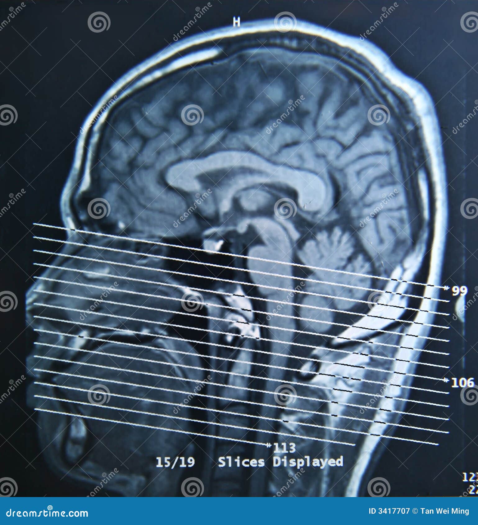 MRI Scan As A Scientific Medical High Tech Modern Background Royalty ...