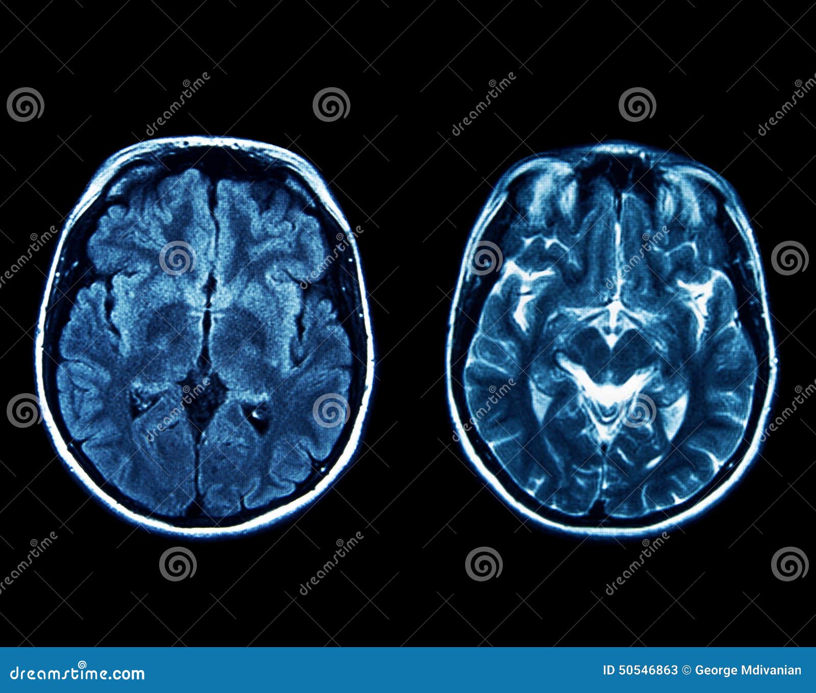 Mri scan stock image. Image of exam, skull, examination - 50546863