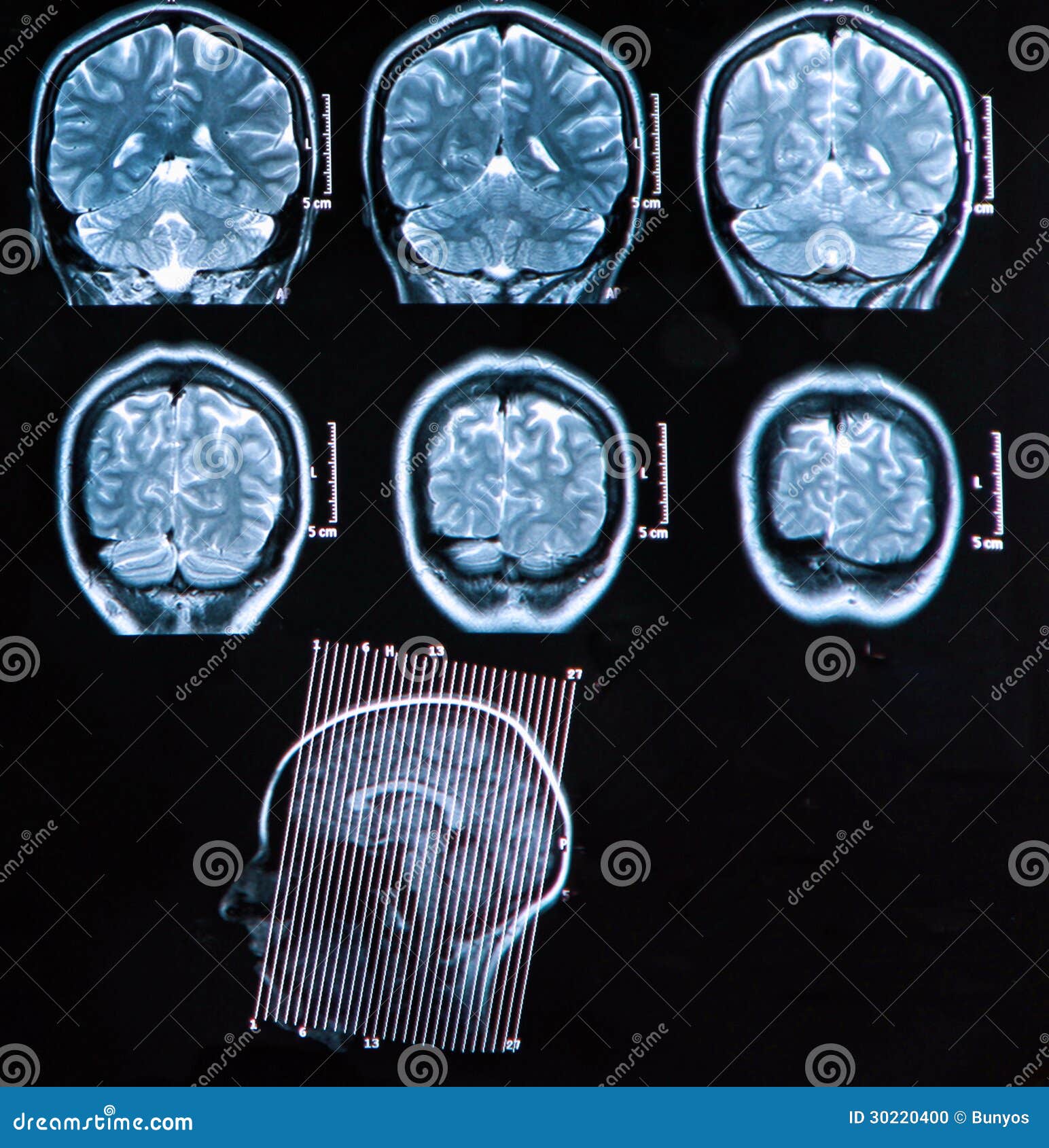 Mri Brain Scan stock photo. Image of cerebellum, cerebral - 30220400