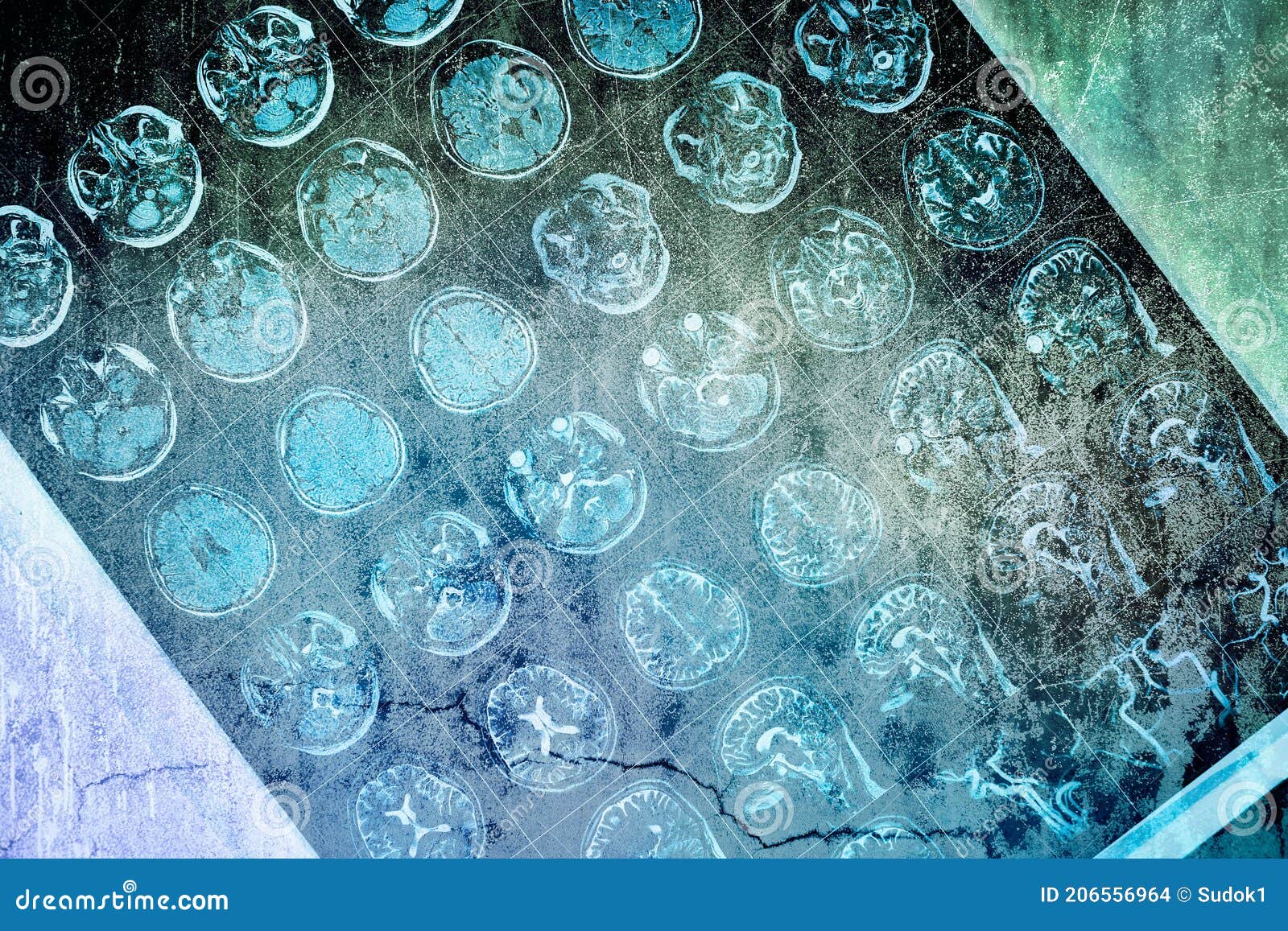 Grunge Human Anatomy Stock Image | CartoonDealer.com #23103157