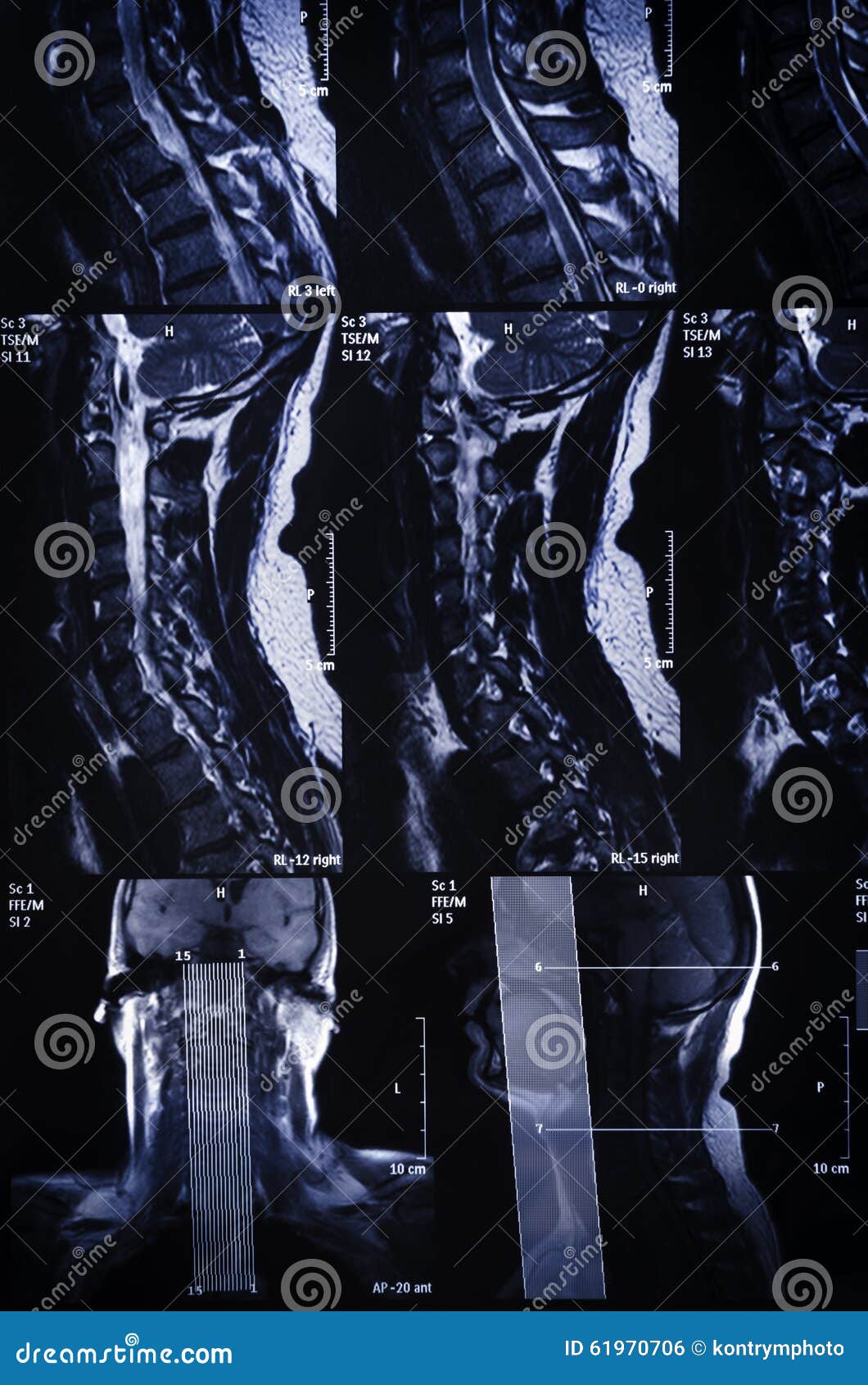 MRI scan stock photo. Image of healthcare, human, diagnostic - 61970706