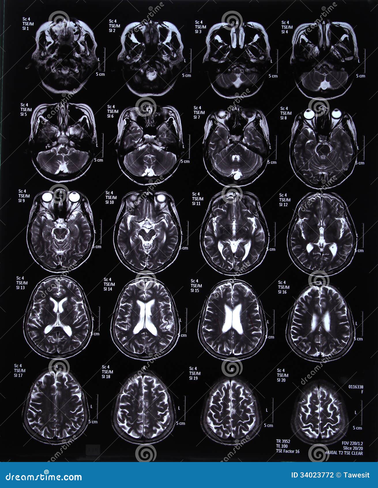 MRI Scan Image Royalty-Free Stock Photography | CartoonDealer.com #80063777