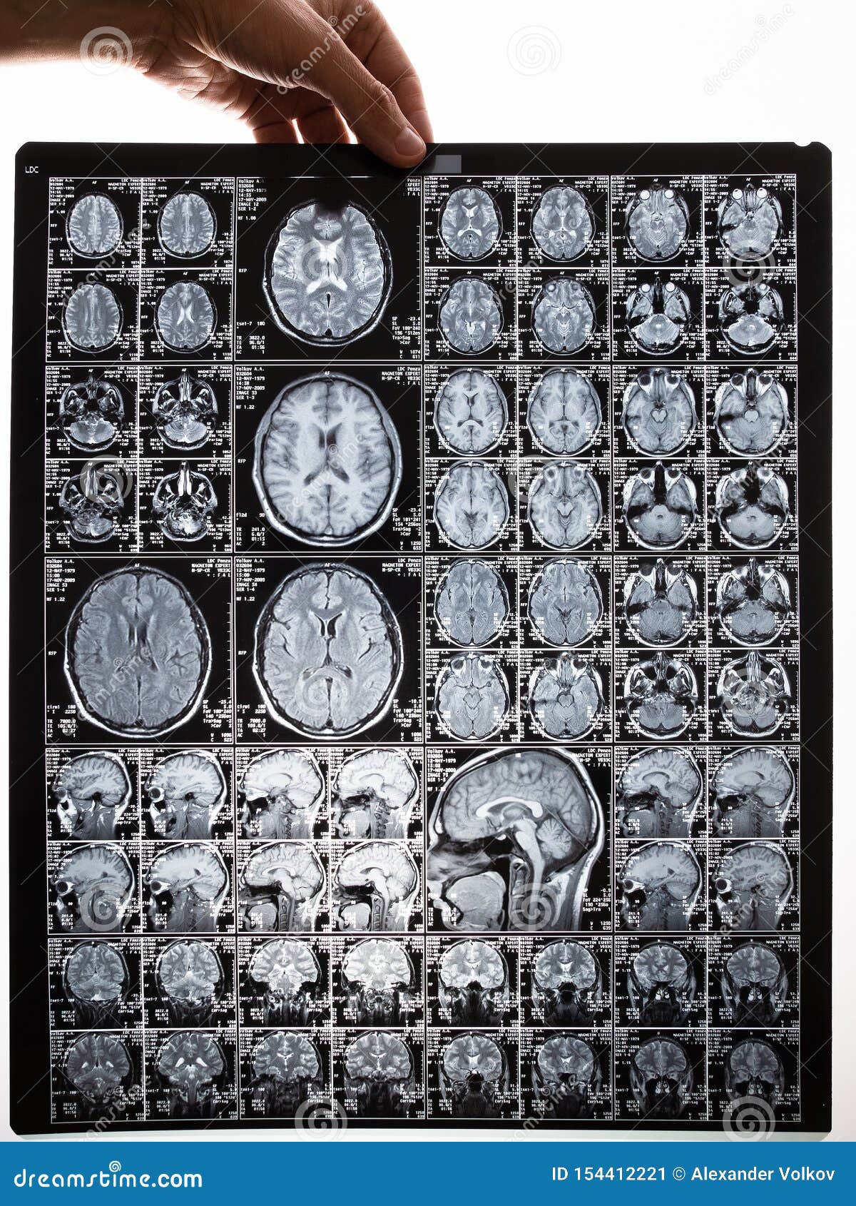 MRI Scan Image of Brain. Holds a Picture in His Hand Stock Image ...