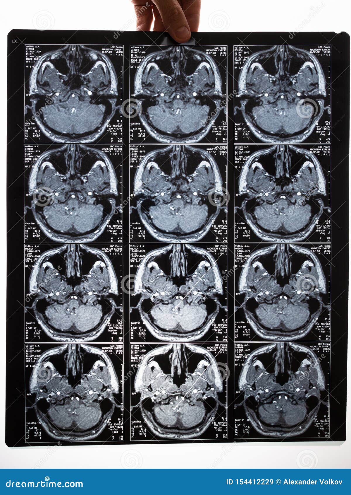 MRI Scan Image of Brain. Holds a Picture in His Hand Stock Image ...