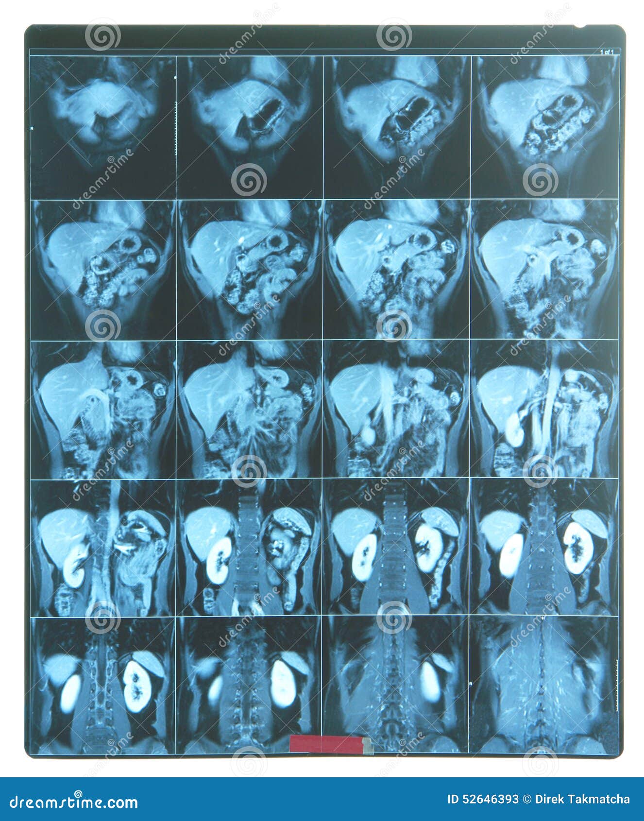 MRI scan image stock image. Image of radiology, neurology - 52646393