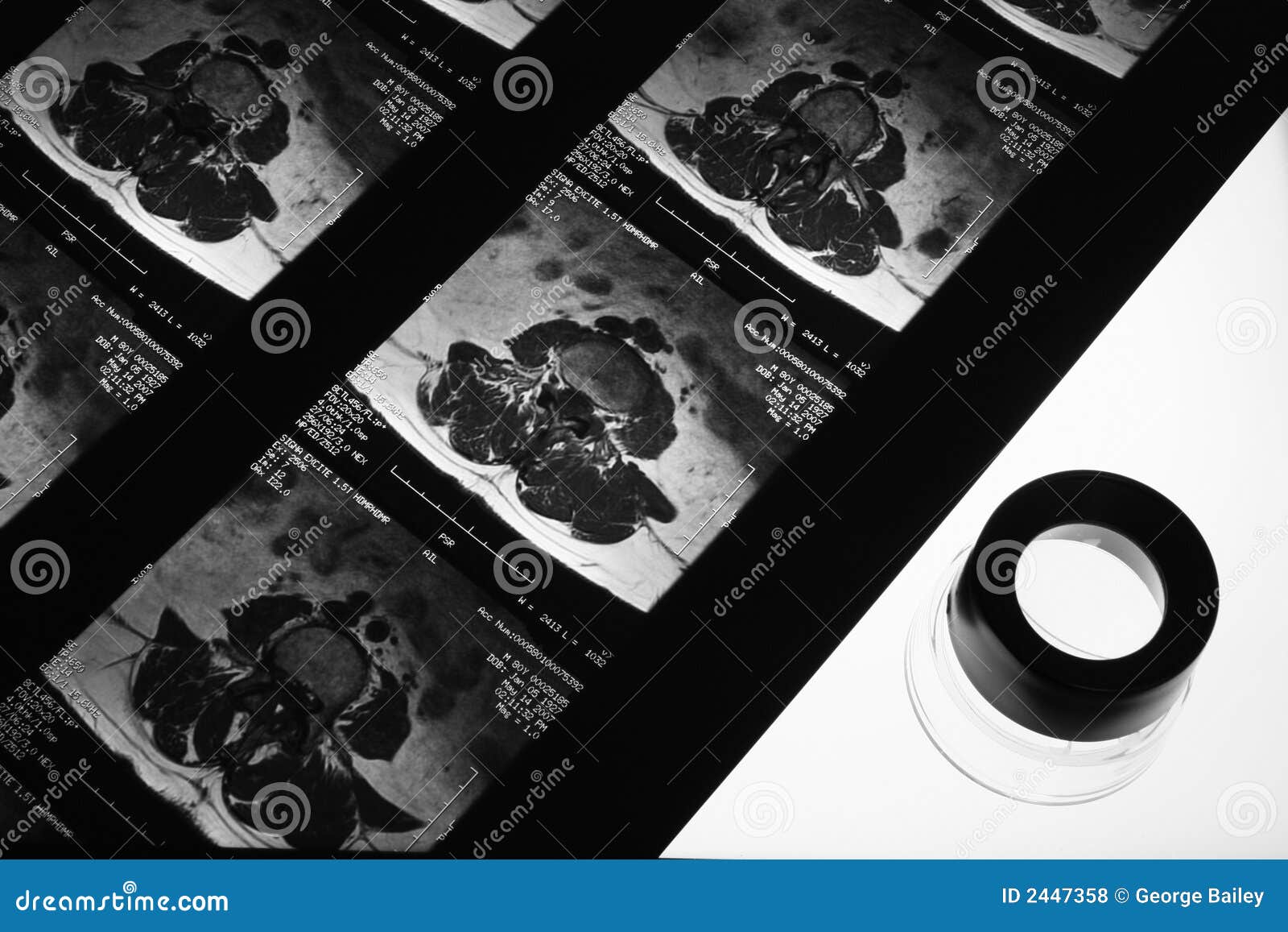 MRI scan on light box stock photo. Image of scanner, people - 2447358