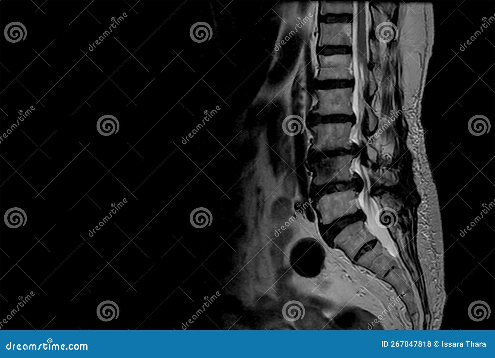 Radiology Sketch Stock Photos - Free & Royalty-Free Stock Photos from ...