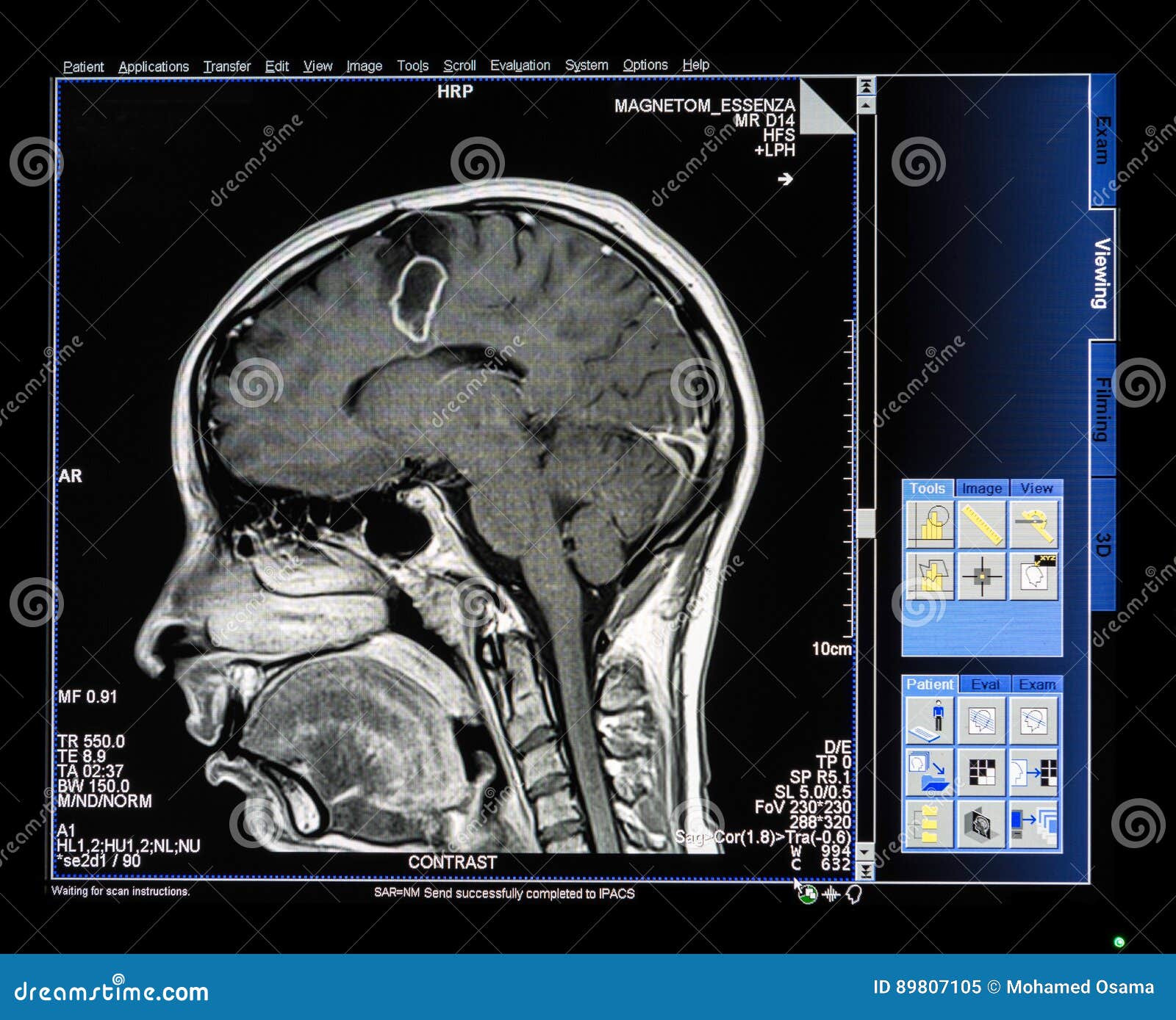 Mri Scan Monitor stock image. Image of brain, examination - 89807105