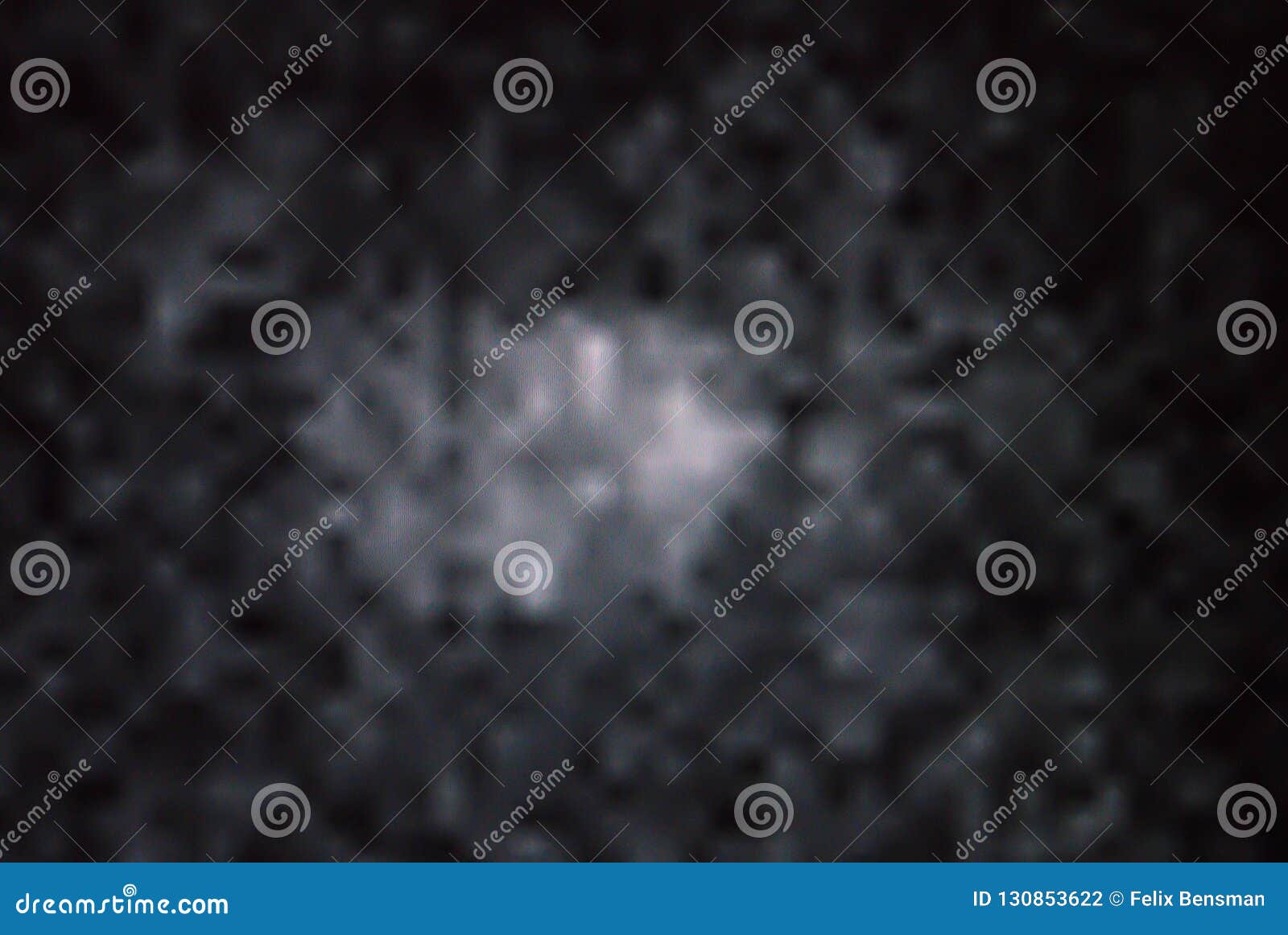 MRT of the Heart and Coronary Vessels Stock Photo - Image of coronary ...