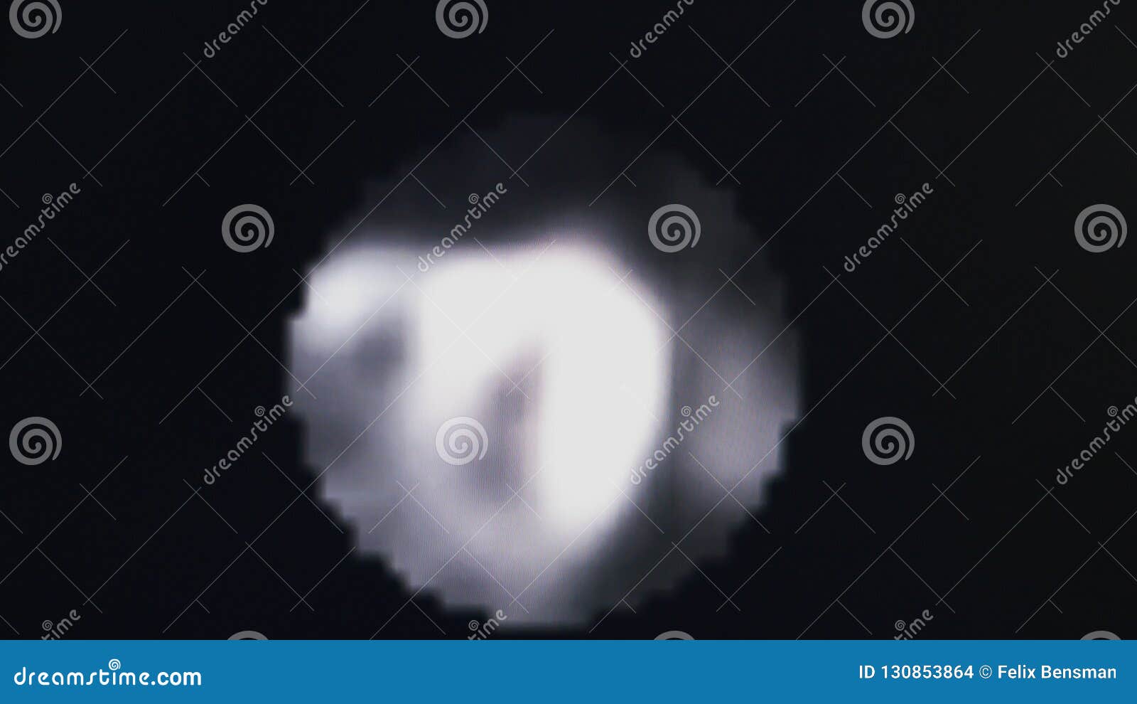 MRT of the Heart and Coronary Vessels Stock Photo - Image of artery ...