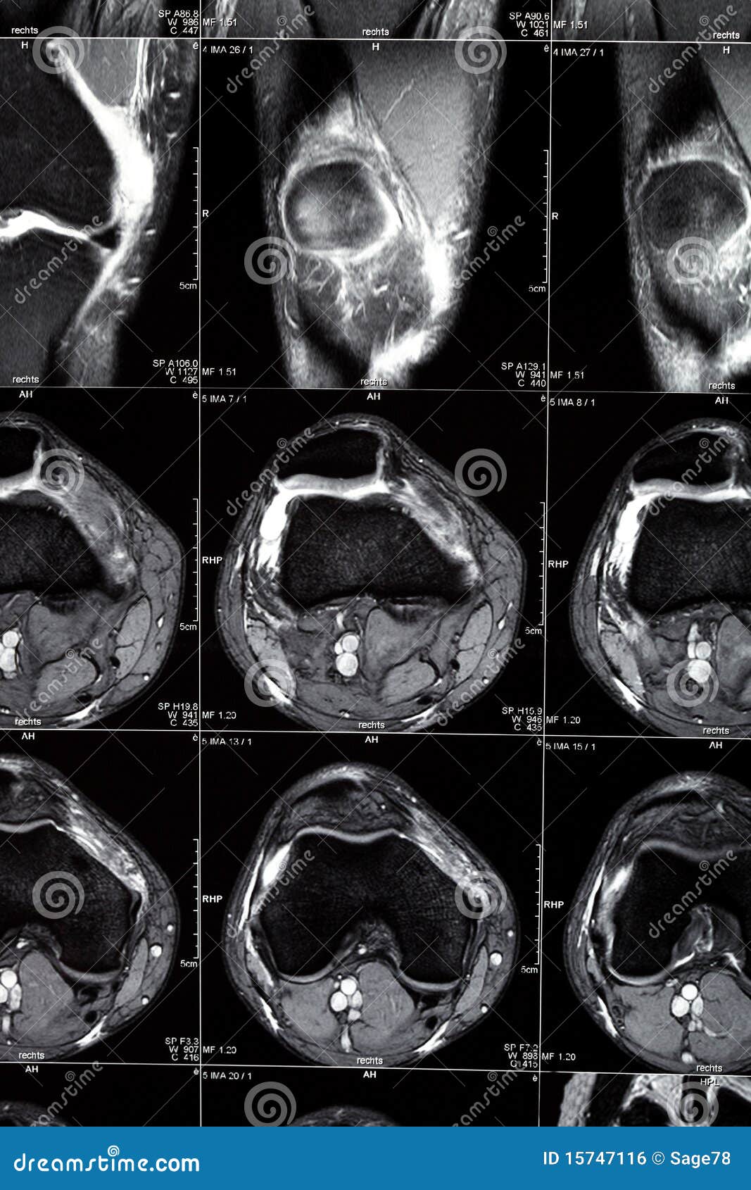 MRT Scan stock photo. Image of practice, radiographer - 15747116
