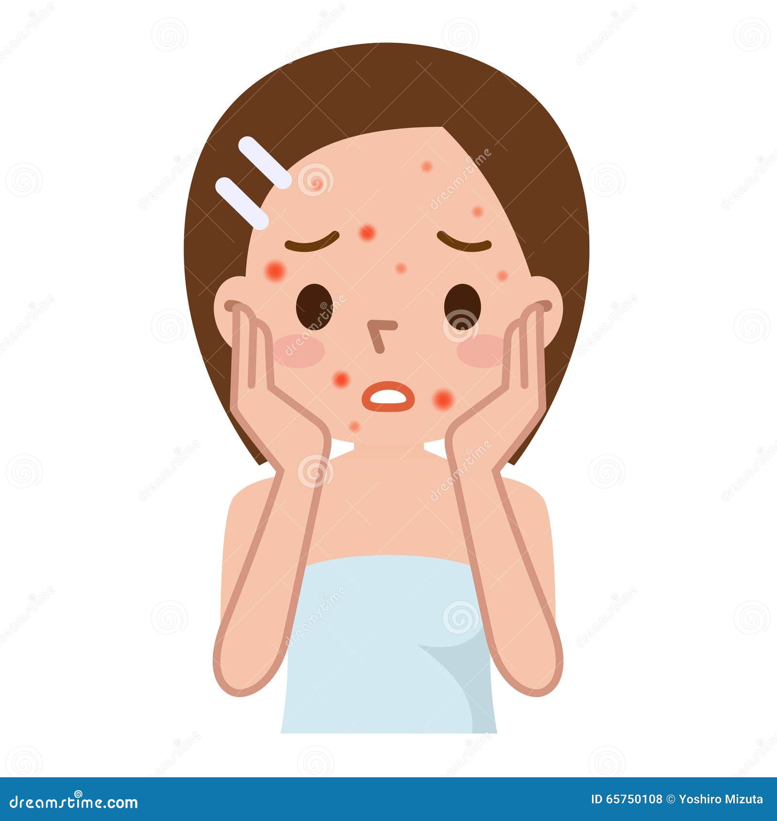 Muchacha Fea De La Piel Del Problema Ilustración del Vector ...