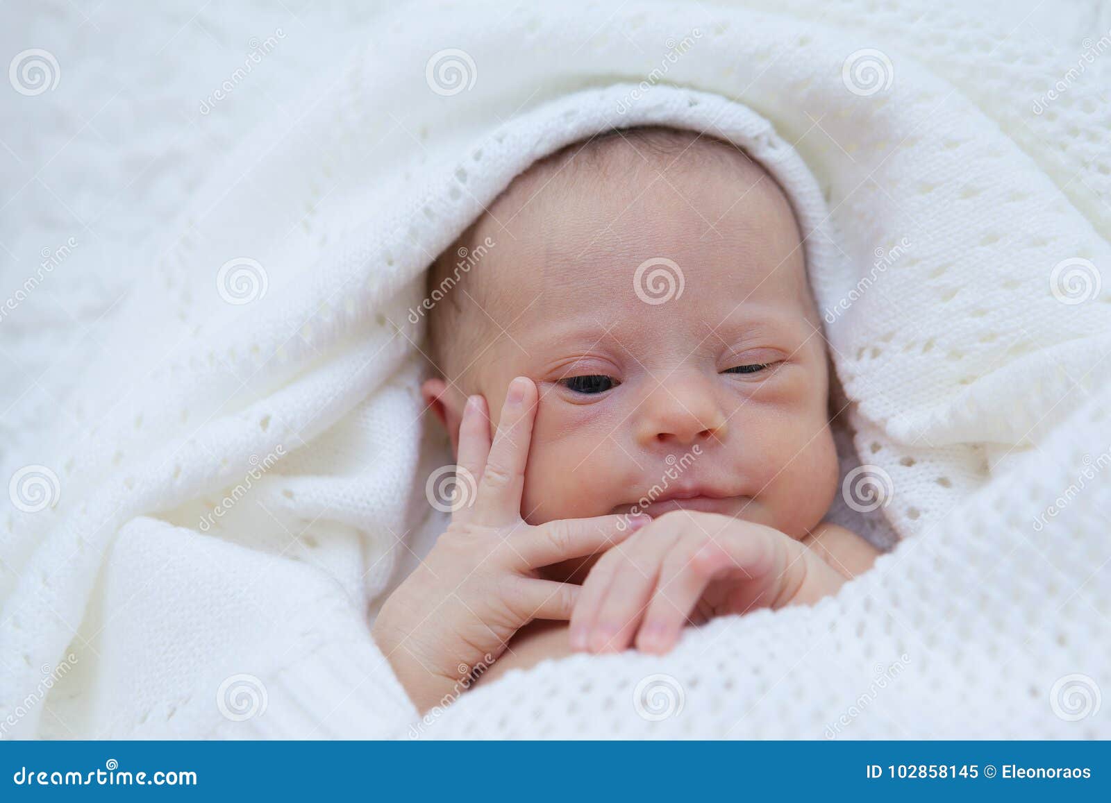 Muchacha Recién Nacida Con Síndrome De Down Imagen de archivo - Imagen ...
