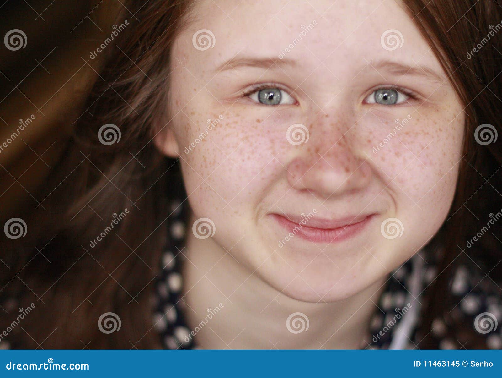 Muchacha Sonriente Con La Cara Pecosa Encantadora Imagen de archivo ...
